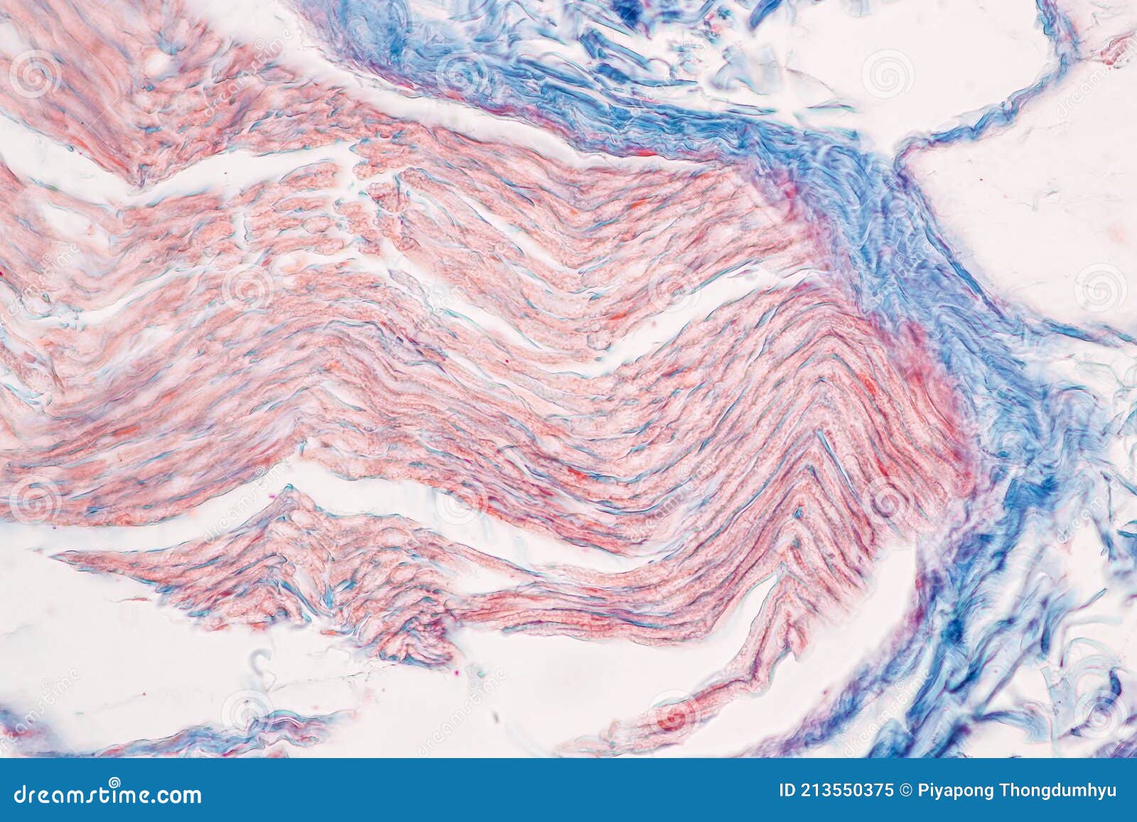 Spinal Cord, Nerve, Cerebellum, Cortex and Motor Neuron Human Under the ...