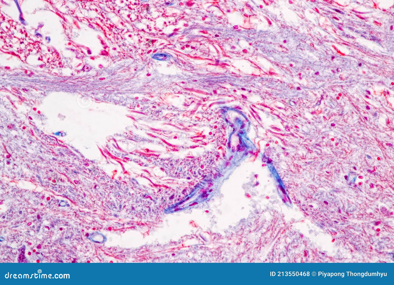 Spinal Cord, Nerve, Cerebellum, Cortex and Motor Neuron Human Under the ...