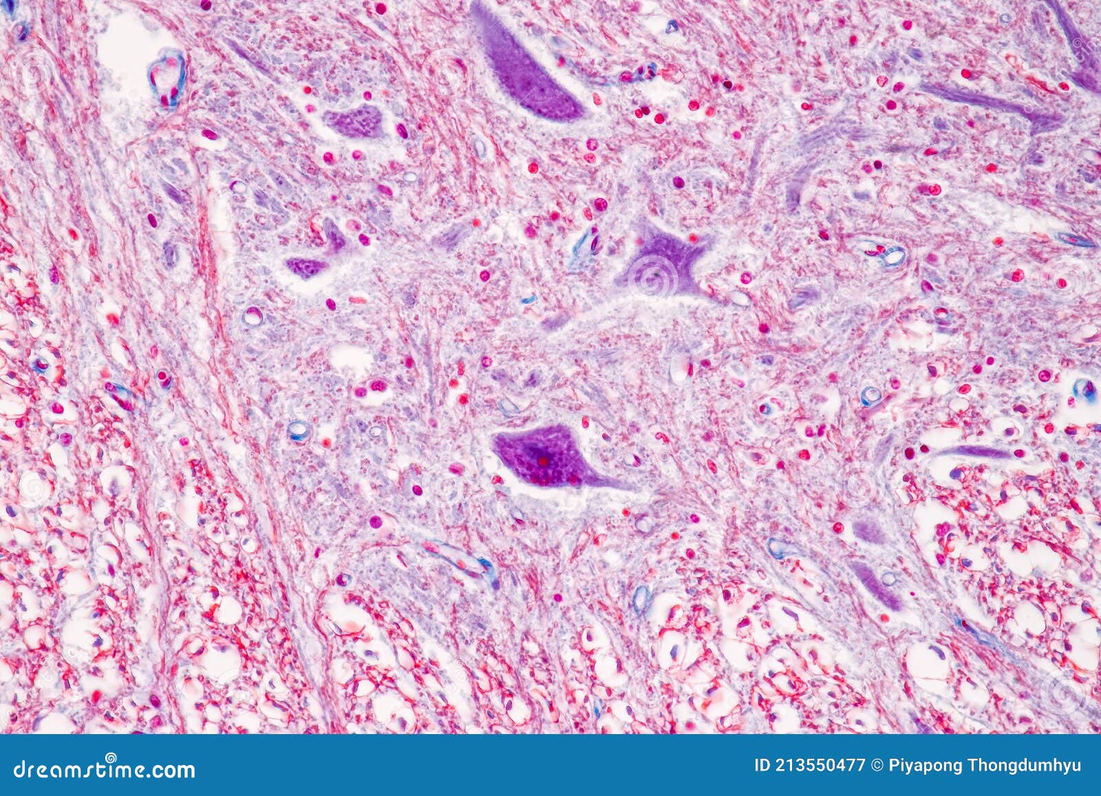 Spinal Cord, Nerve, Cerebellum, Cortex and Motor Neuron Human Under the ...
