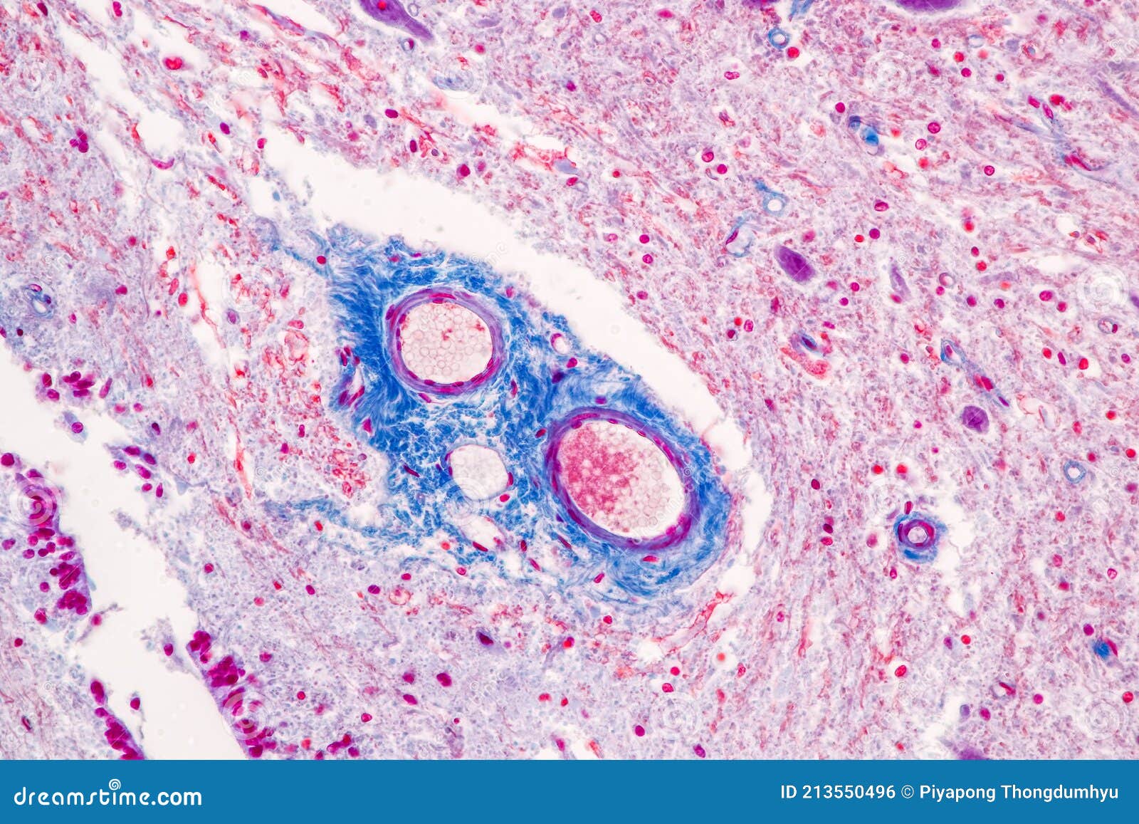Spinal Cord, Nerve, Cerebellum, Cortex and Motor Neuron Human Under the ...