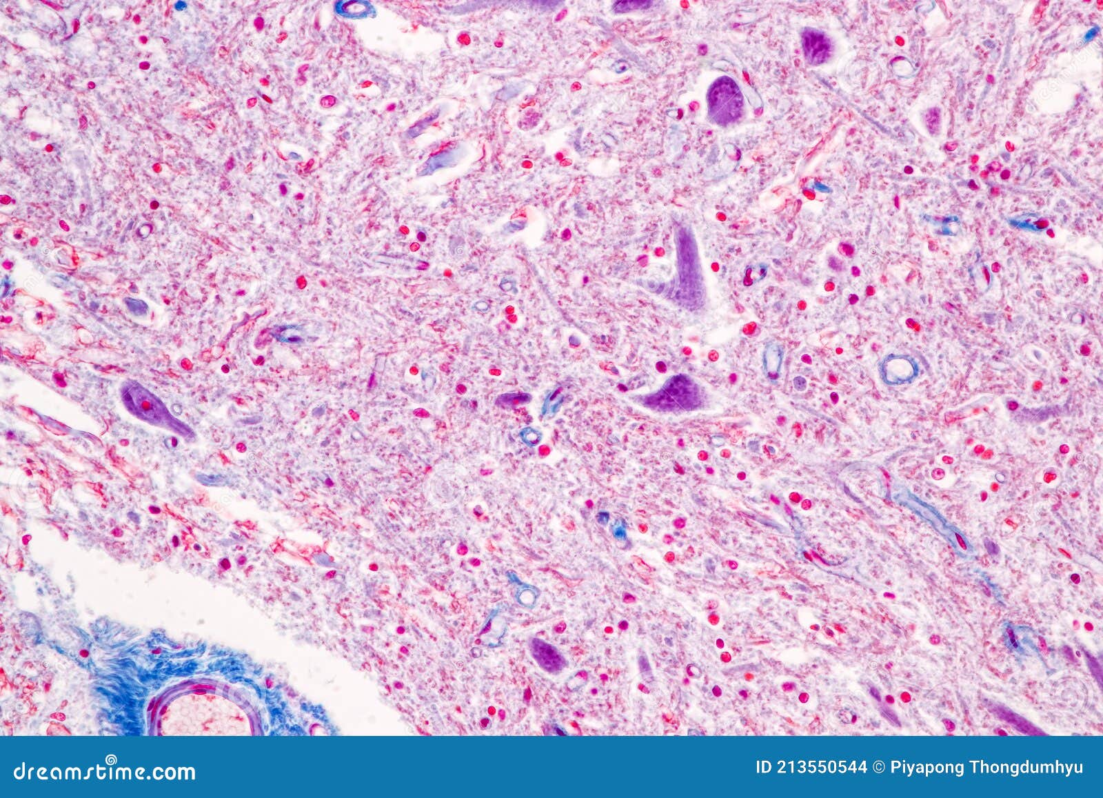 Spinal Cord, Nerve, Cerebellum, Cortex and Motor Neuron Human Under the ...