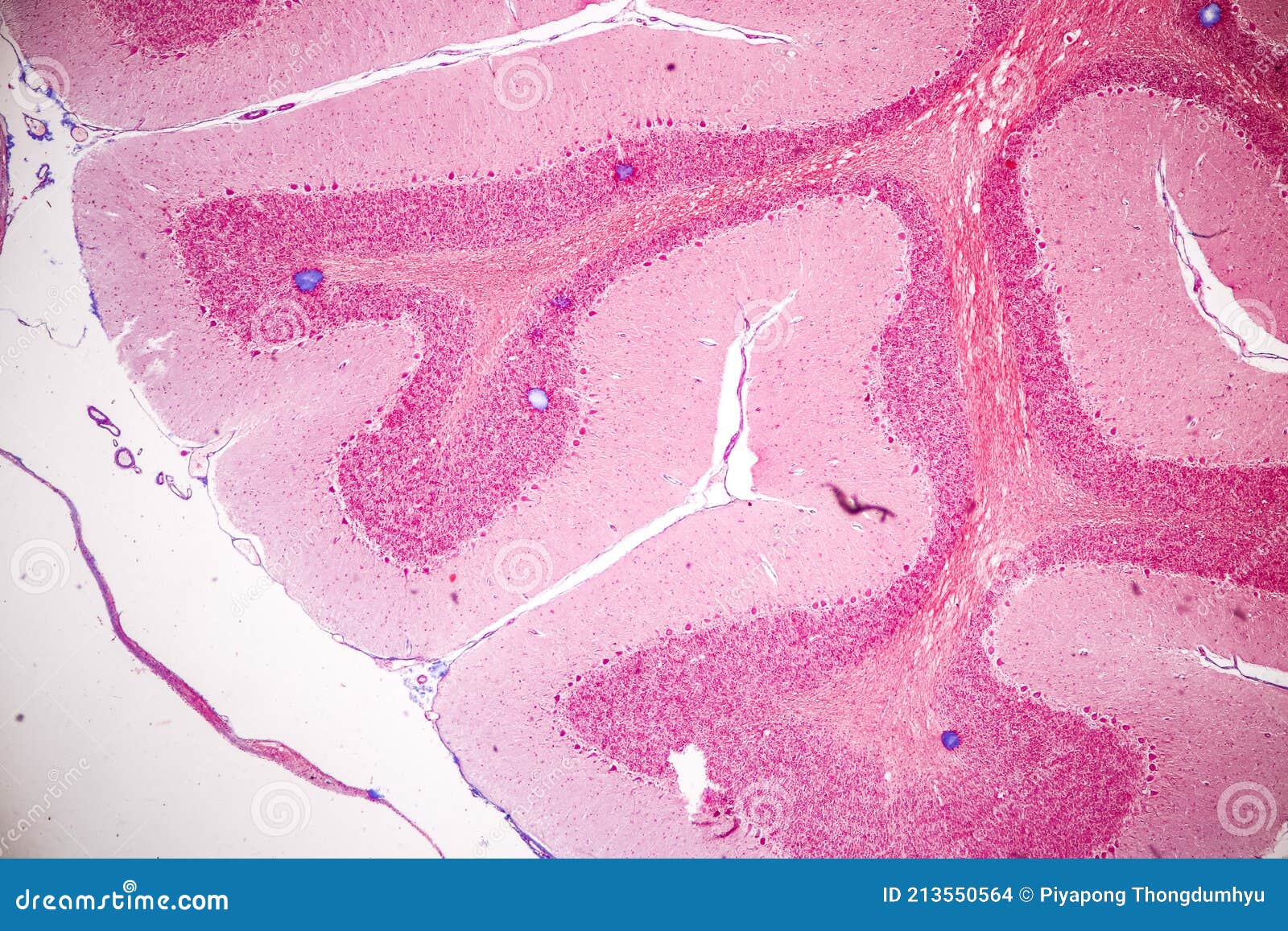 Motor Neuron And Nerve Cells Under The Microscope. Stock Photo ...