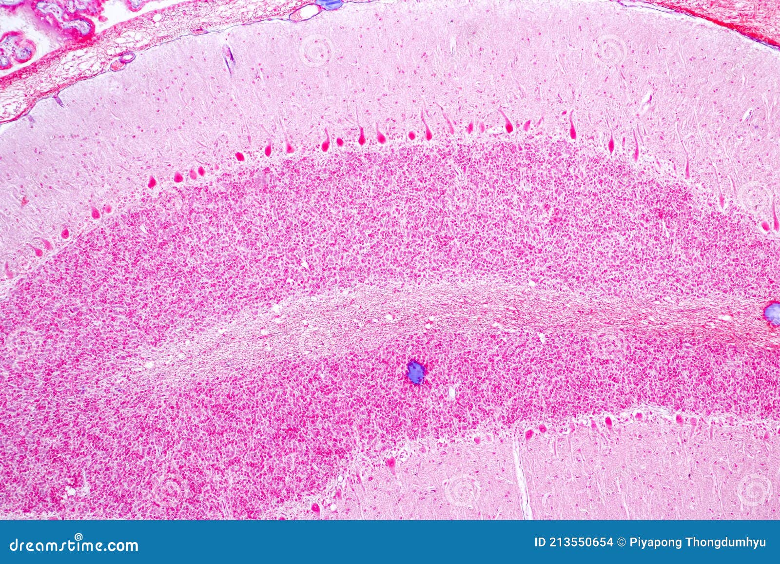 Spinal Cord, Nerve, Cerebellum, Cortex and Motor Neuron Human Under the ...