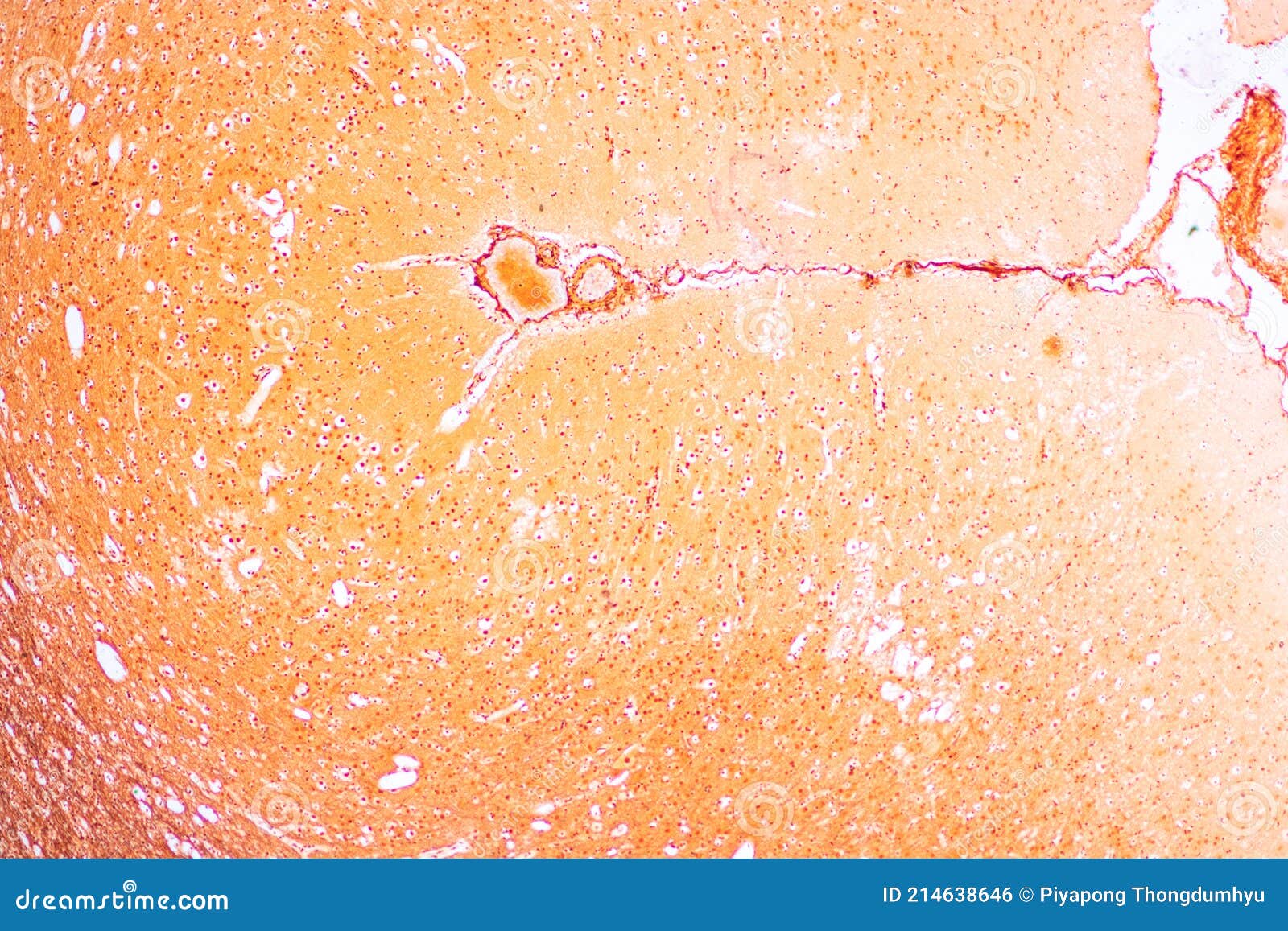 Spinal Cord, Nerve, Cerebellum, Cortex and Motor Neuron Human Under the ...