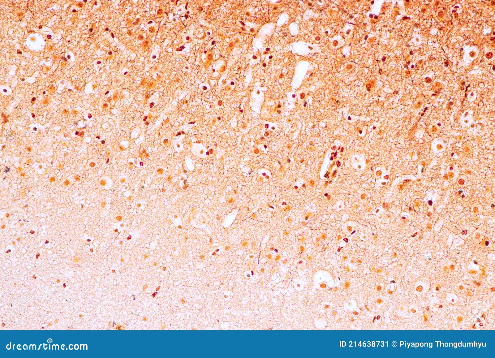 Spinal Cord, Nerve, Cerebellum, Cortex and Motor Neuron Human Under the ...