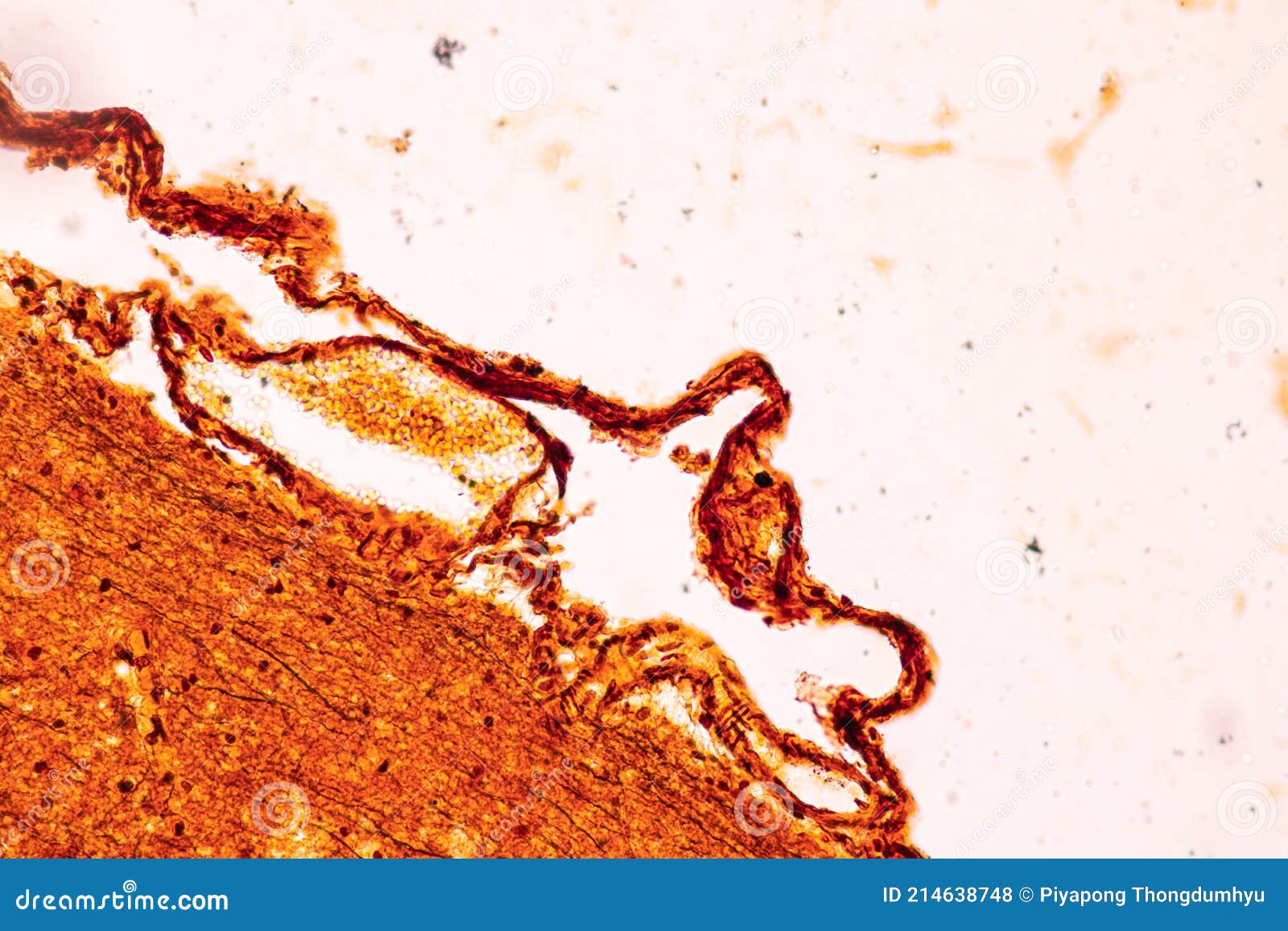 Spinal Cord, Nerve, Cerebellum, Cortex and Motor Neuron Human Under the ...