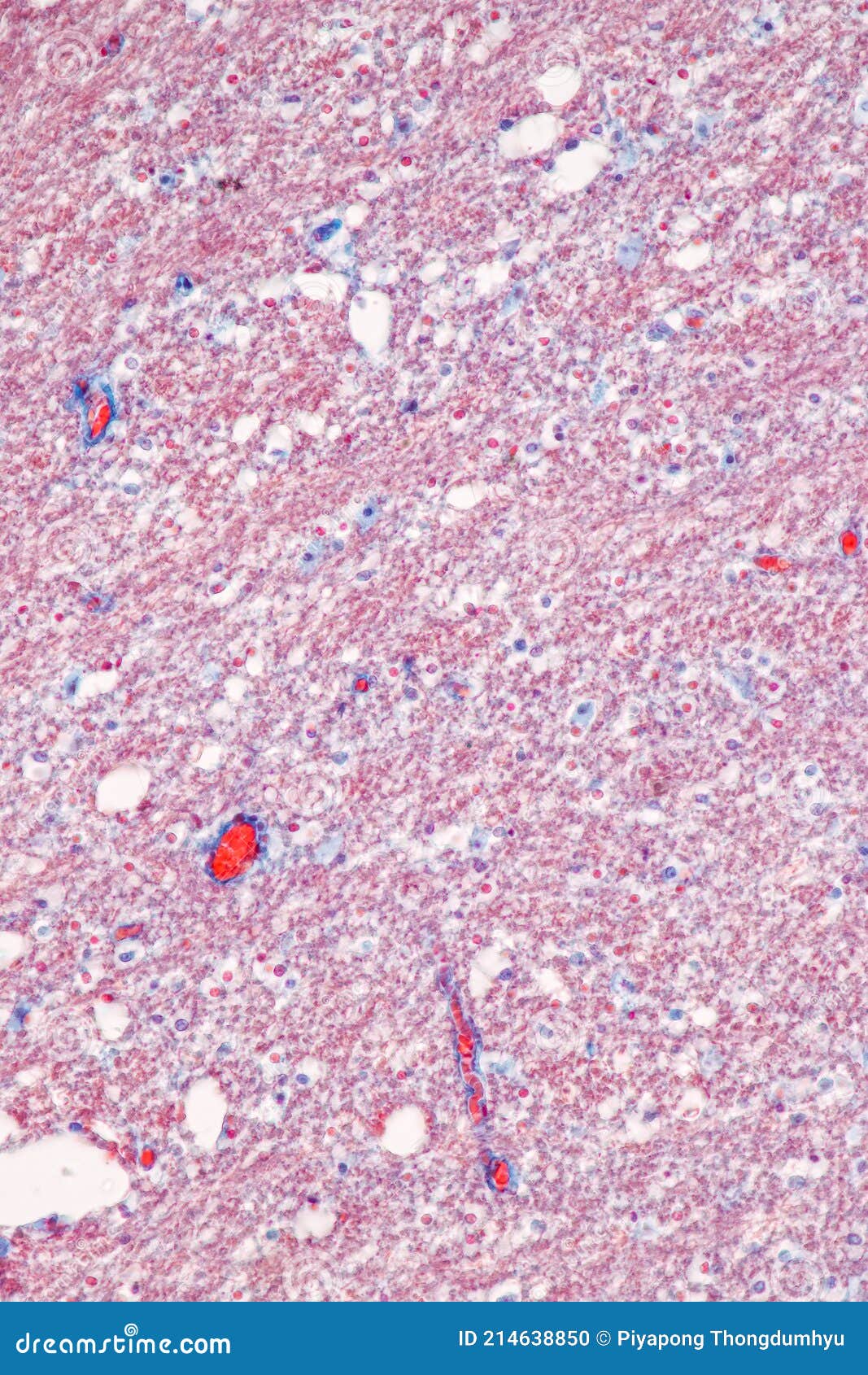 Spinal Cord, Nerve, Cerebellum, Cortex and Motor Neuron Human Under the ...