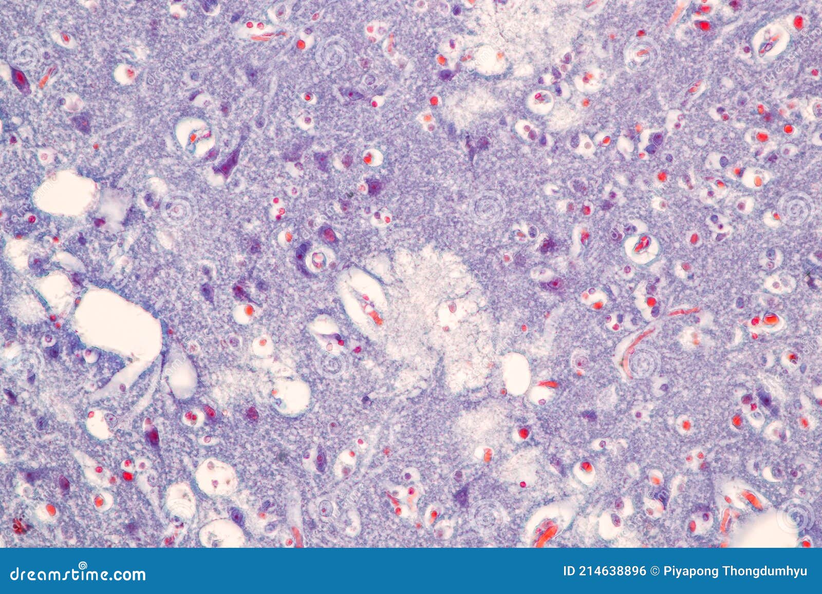 Spinal Cord, Nerve, Cerebellum, Cortex and Motor Neuron Human Under the ...