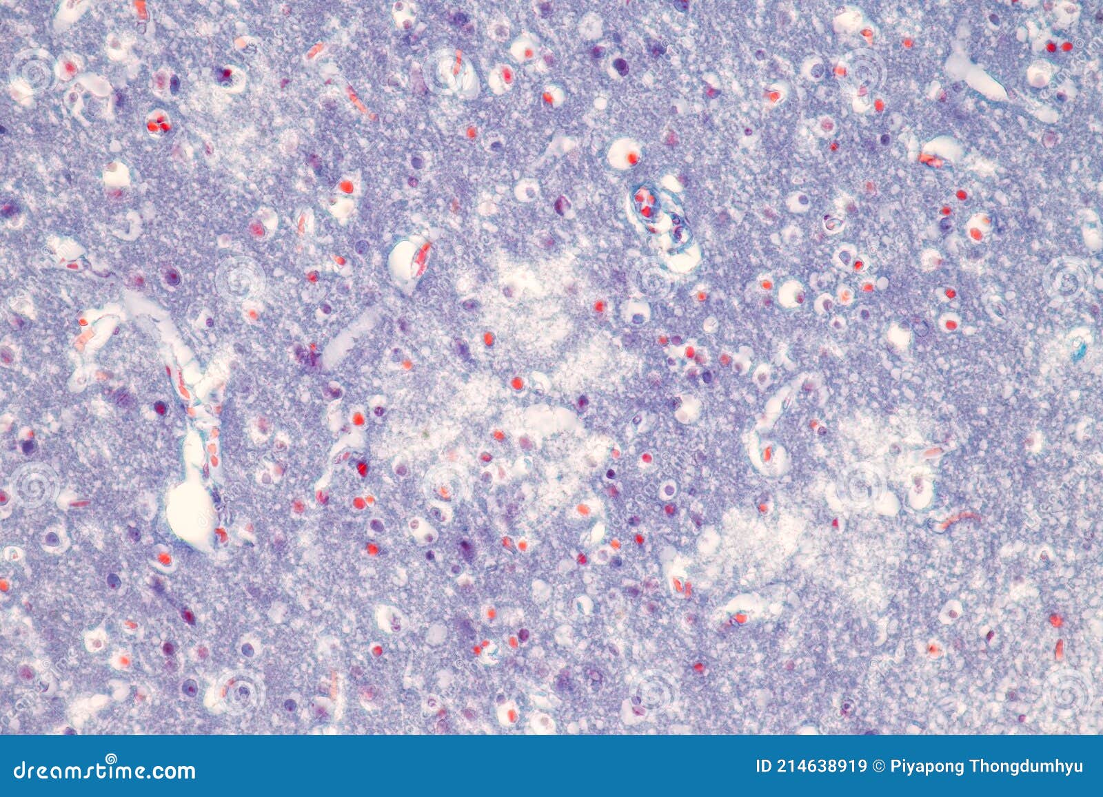 Spinal Cord, Nerve, Cerebellum, Cortex and Motor Neuron Human Under the ...
