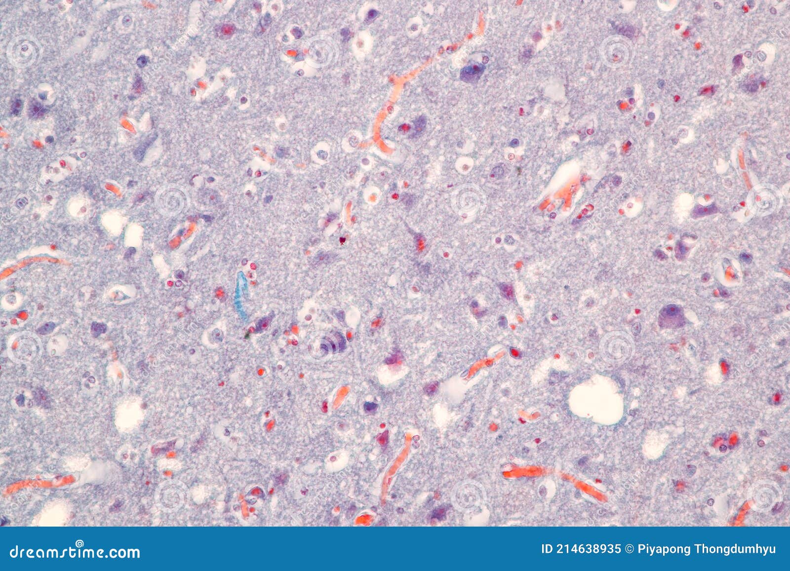 Spinal Cord, Nerve, Cerebellum, Cortex and Motor Neuron Human Under the ...