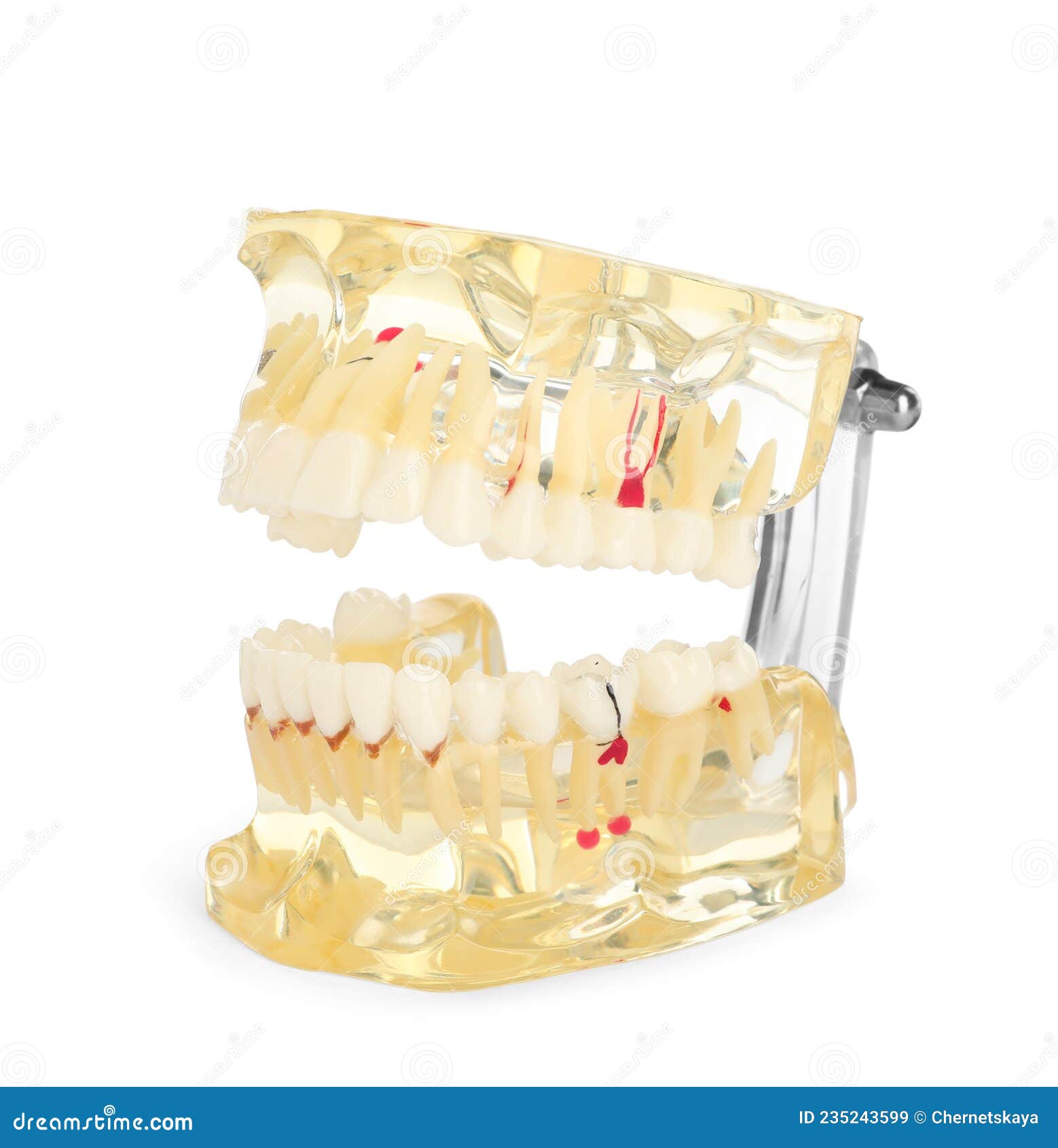 Set With Educational Dental Models And Money On White Background ...