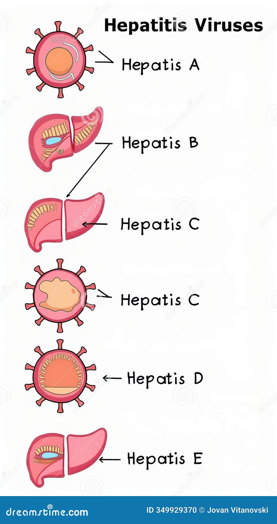 Educational Infographic Illustrating the Structure of Hepatitis Viruses ...