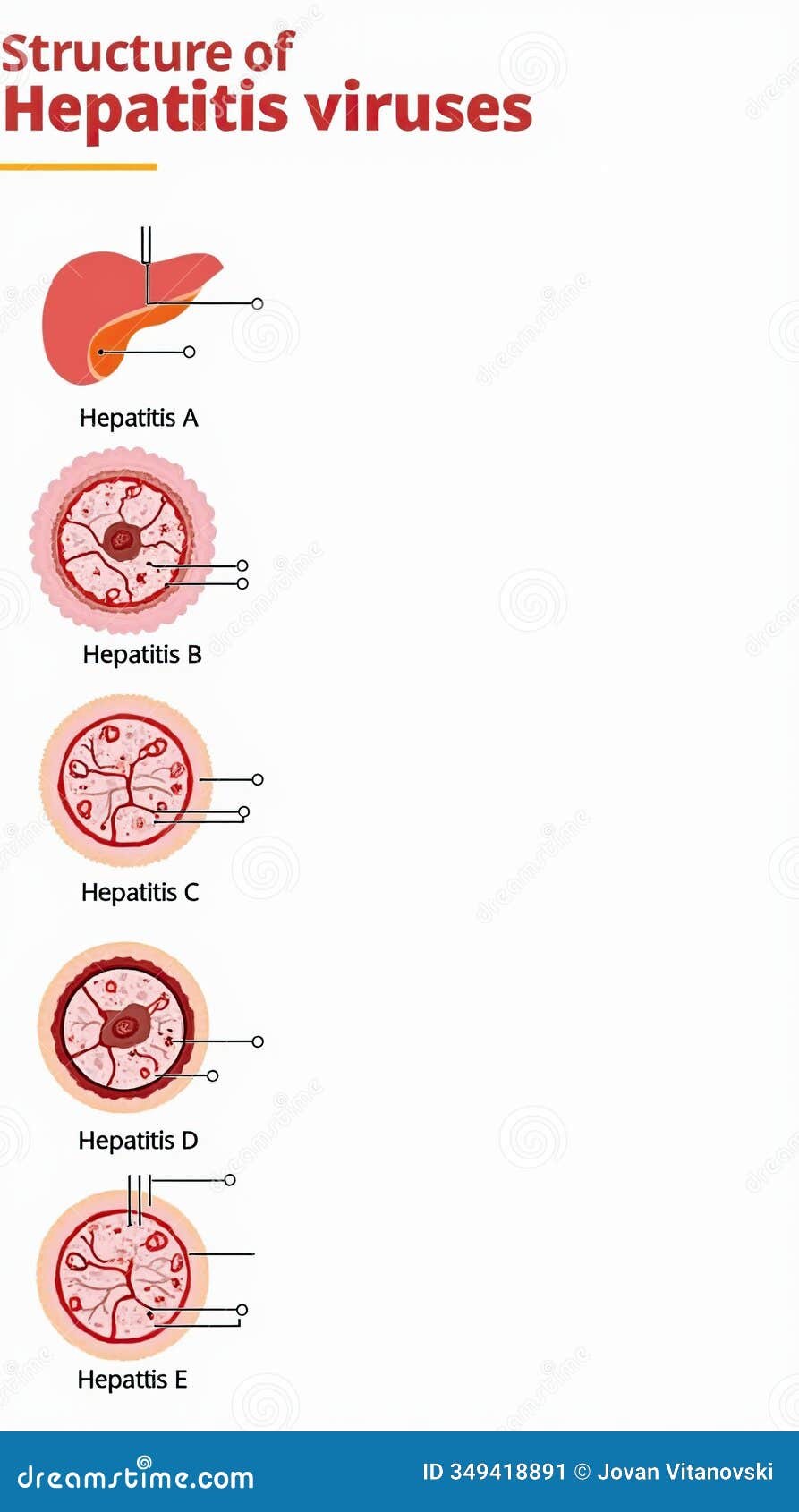 Detailed Infographic Illustrating Structures of Hepatitis a To E ...