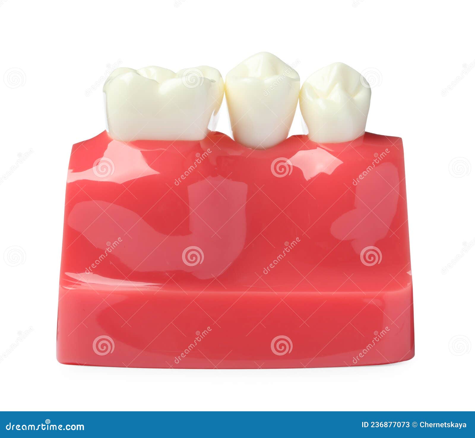 Educational Model of Gum with Teeth on White Background Stock Image ...