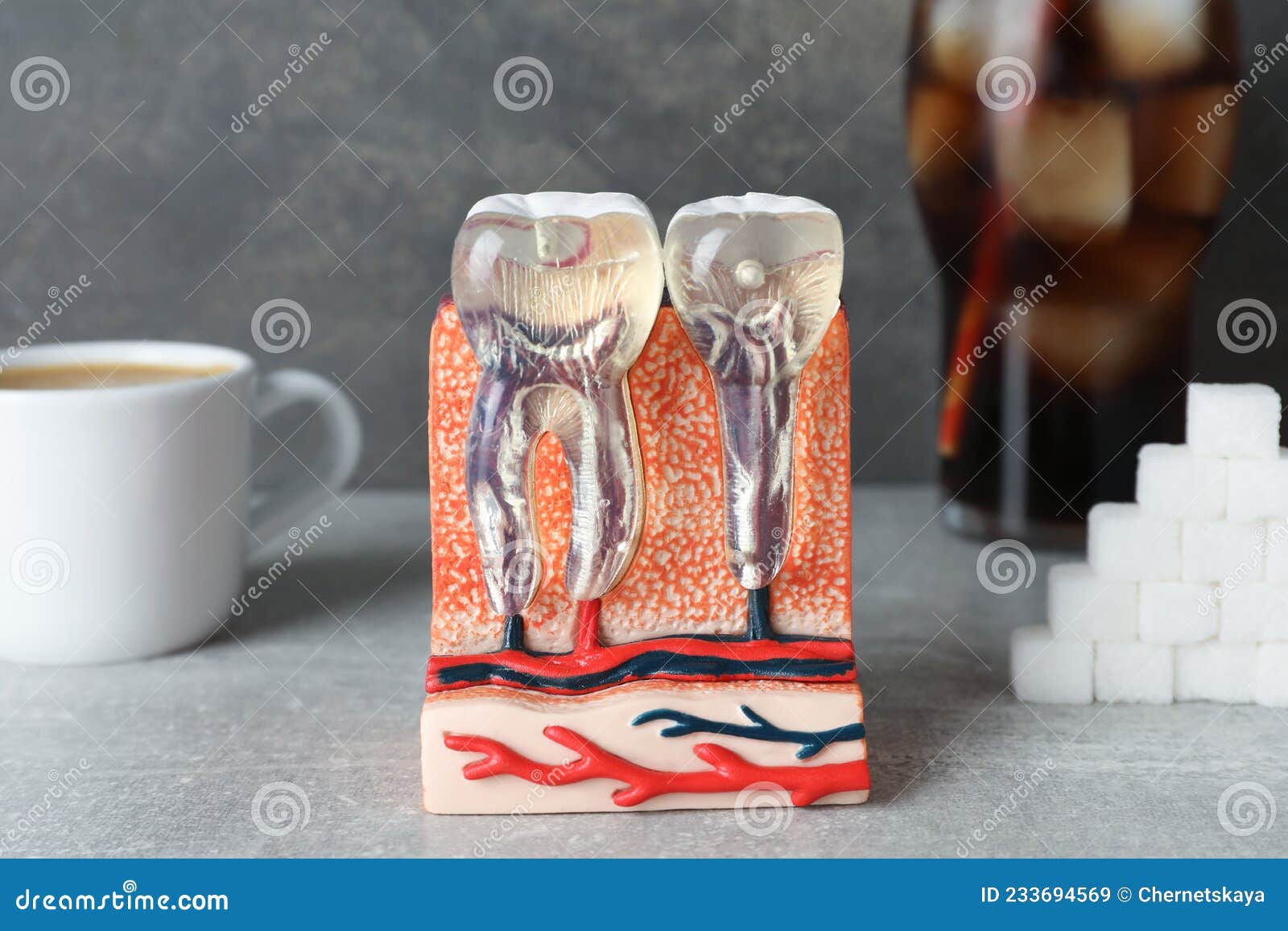 Educational Model of Jaw Section with Teeth and Sugar on Grey Table ...