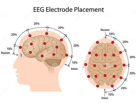 EEG electrode placement stock vector. Illustration of medical - 29444803