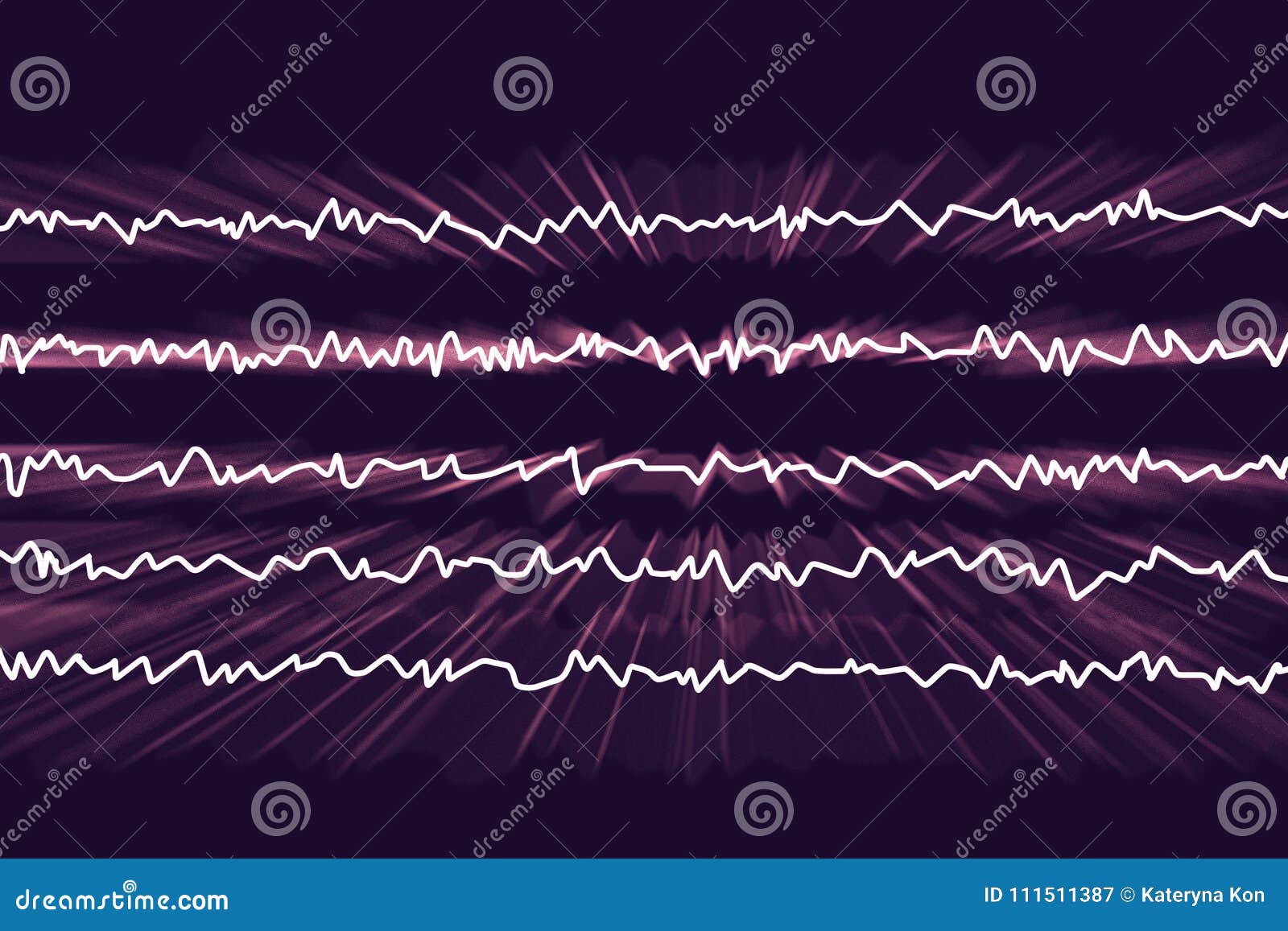 EEG Electroencephalogram, Brain Wave in Awake State with Mental ... EEG Electroencephalogram, Brain Wave in Awake State with Mental ...