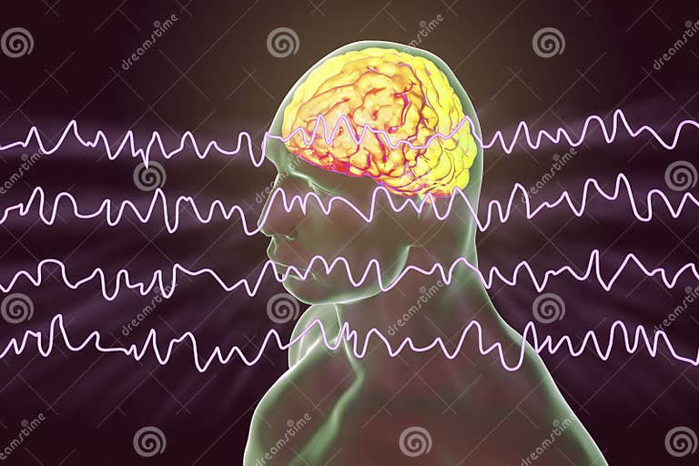 EEG Electroencephalogram, Brain Wave in Awake State during Rest Stock ...