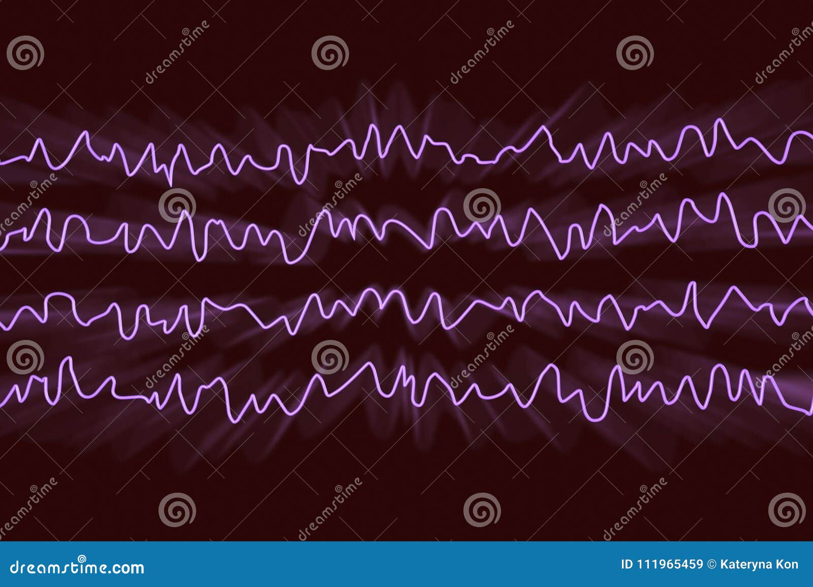 EEG Electroencephalogram, Brain Wave In Awake State During Rest Royalty ...