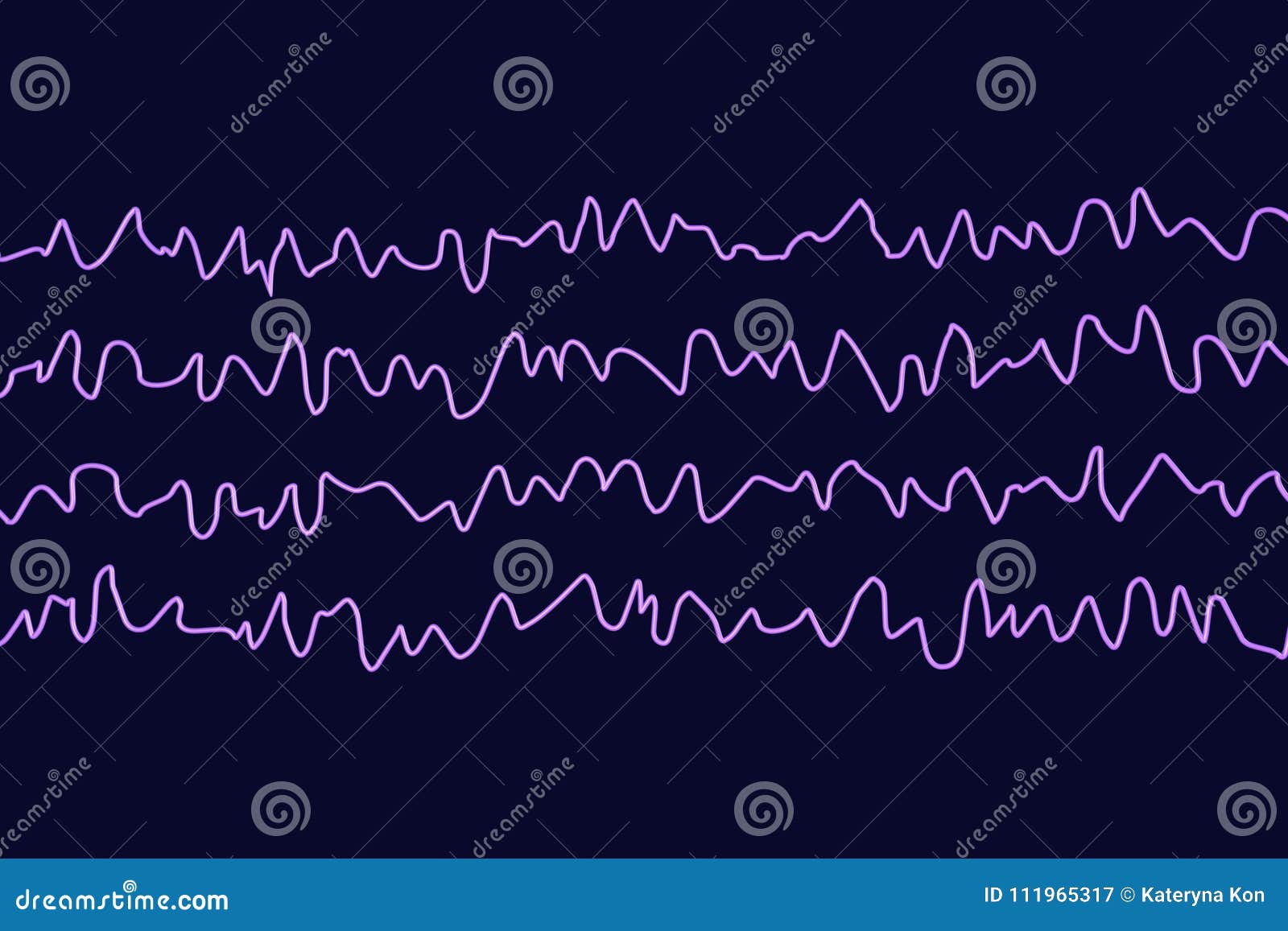 EEG Electroencephalogram, Brain Wave in Awake State during Rest Stock ... EEG Electroencephalogram, Brain Wave in Awake State during Rest Stock ...