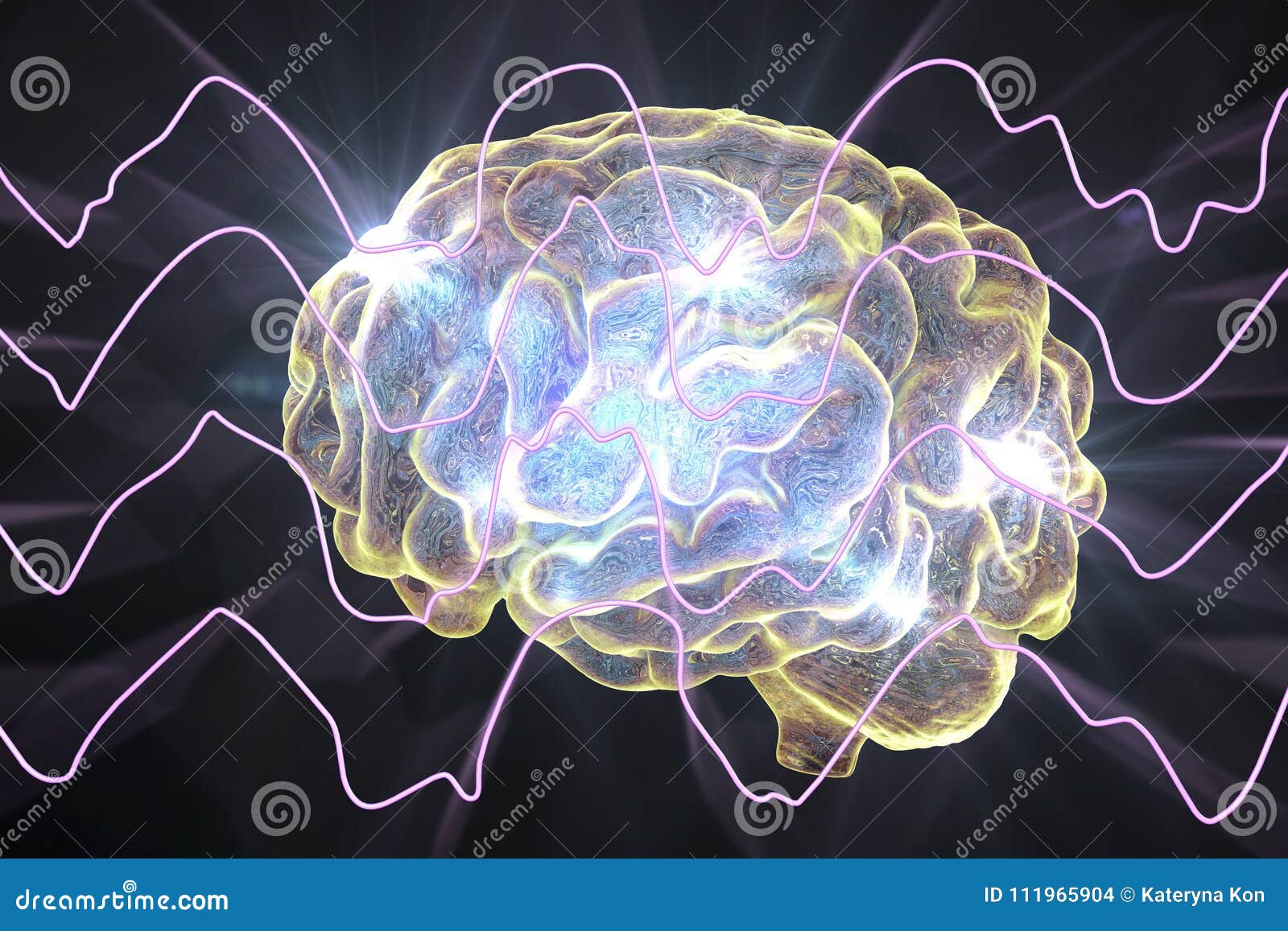 EEG Electroencephalogram, Brain Wave During Sleeping Royalty-Free ... EEG Electroencephalogram, Brain Wave During Sleeping Royalty-Free ...