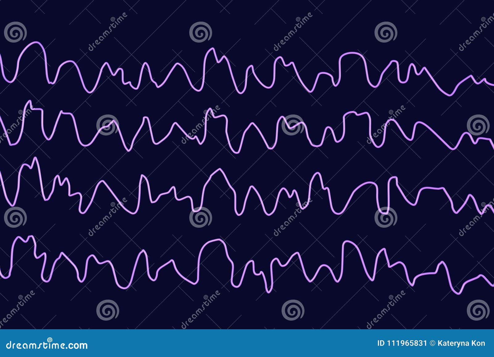 EEG Electroencephalogram, Brain Wave During Sleeping Royalty-Free ... EEG Electroencephalogram, Brain Wave During Sleeping Royalty-Free ...