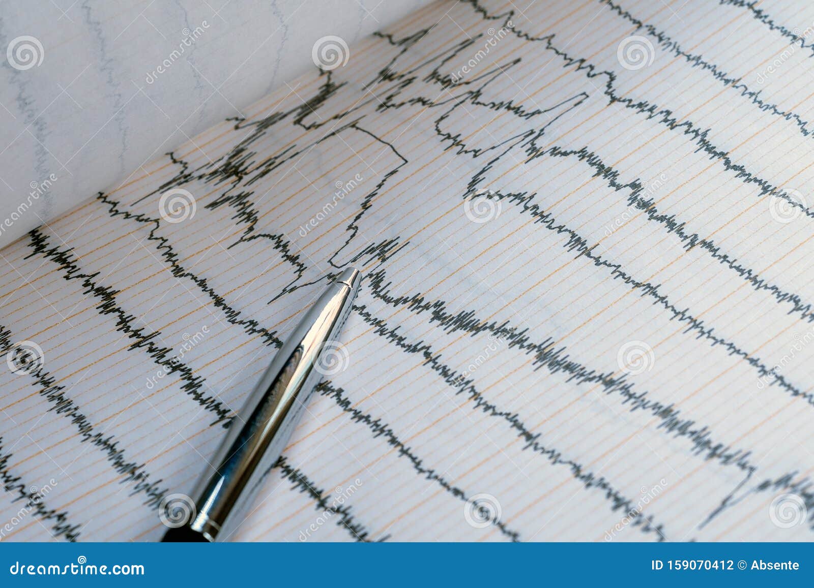 EEG wave in human brain stock photo. Image of chart - 159070412