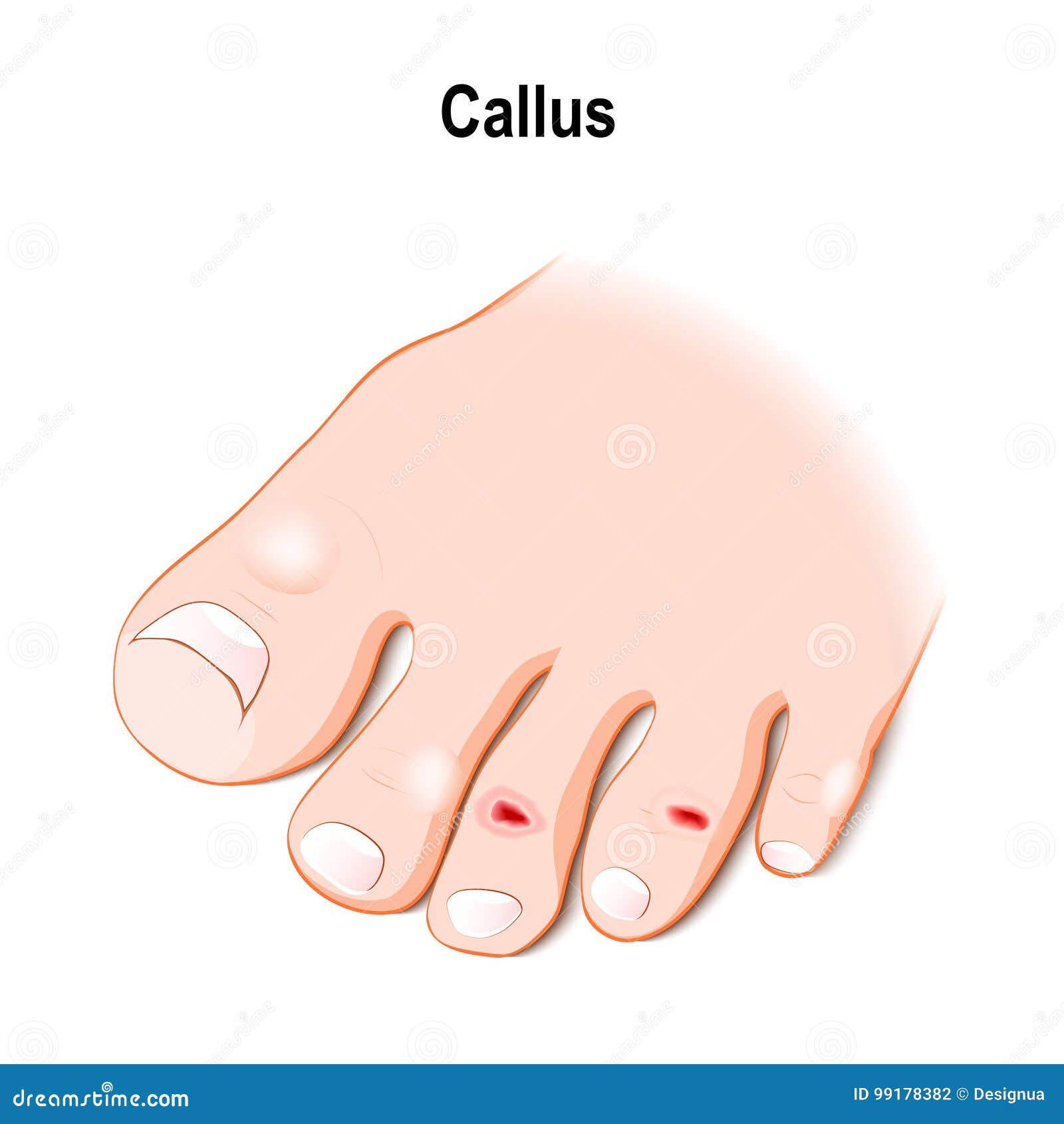 Eeltplek of eelt vector illustratie. Illustration of namen - 99178382