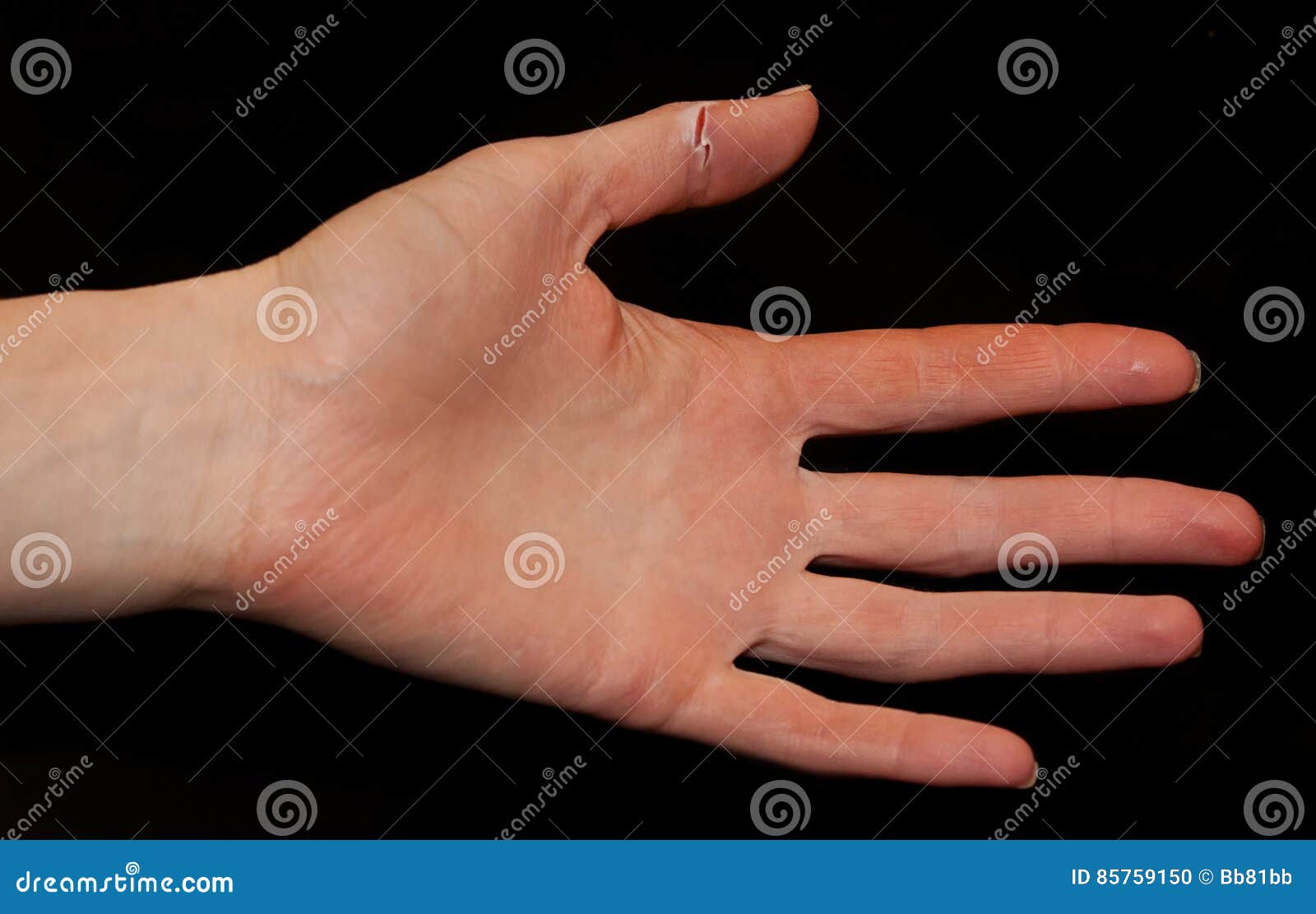 Een Diepe Wond Op De Vinger Stock Foto - Image of bloed, verwonding ...