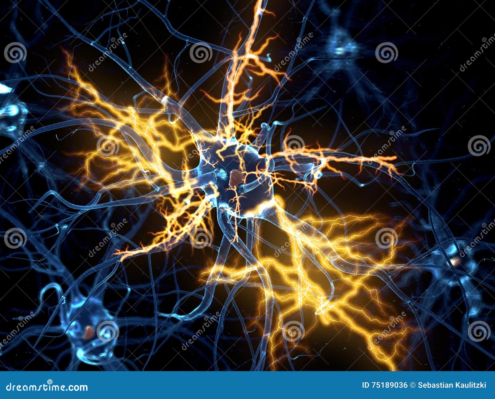 Een zenuwcel stock illustratie. Illustration of ontstoken - 75189036