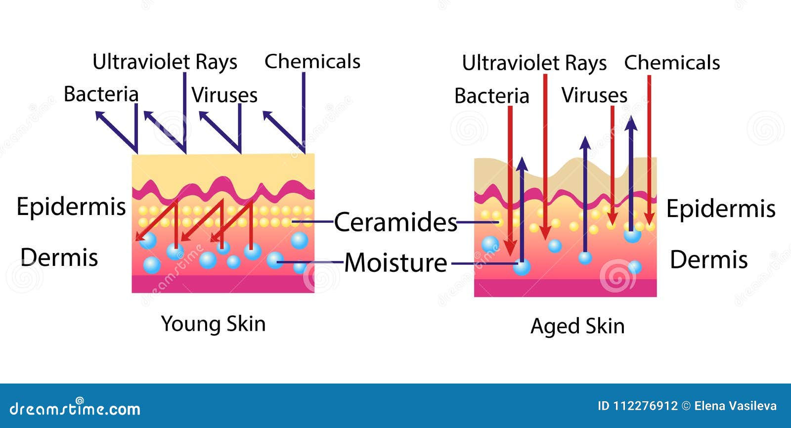 Effect of Environment on the Skin, Vector Diagram for Cosmetological ...