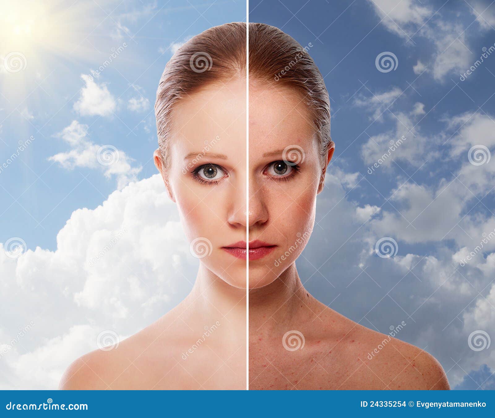Effect of Healing of Skin, Beauty Woman Stock Photo - Image of eyes ...