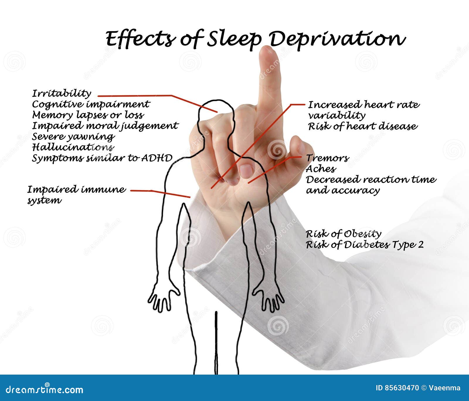 Effects of Sleep Deprivation Stock Photo - Image of lapses, cognitive ...