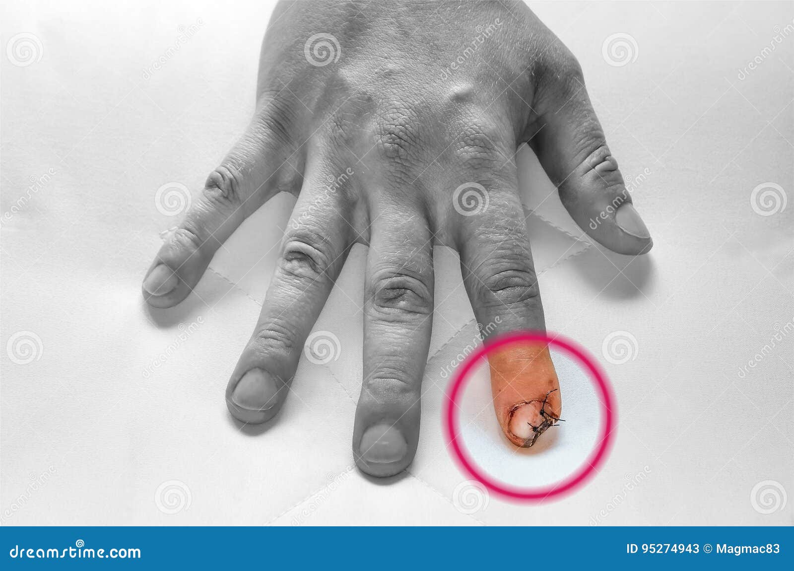 Accident Du Travail Stock Images - 1,906 Photos - Page 2