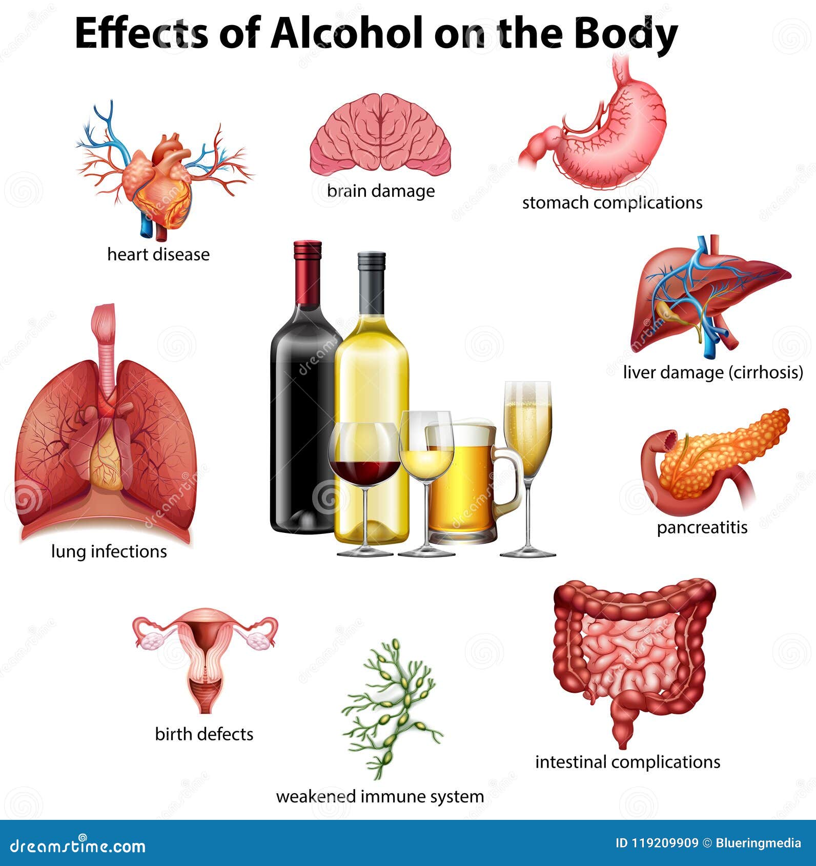 Effetti Di Alcool Sul Corpo Illustrazione Vettoriale - Illustrazione di ...