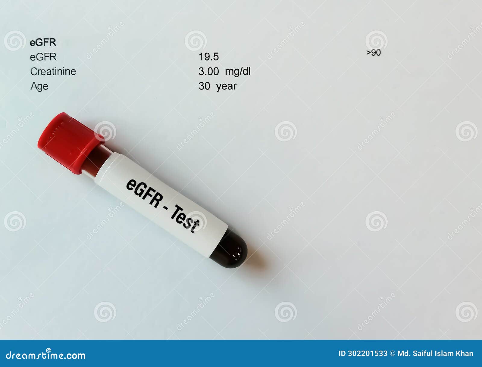 EGFR Test with Abnormal Report, CKD Stock Image - Image of creatinine ...