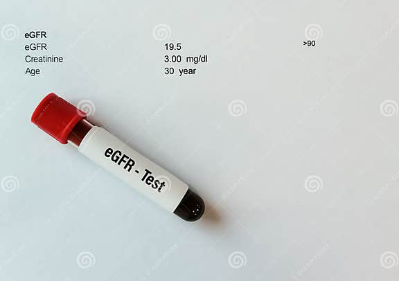 EGFR Test with Abnormal Report, CKD Stock Image - Image of creatinine ...