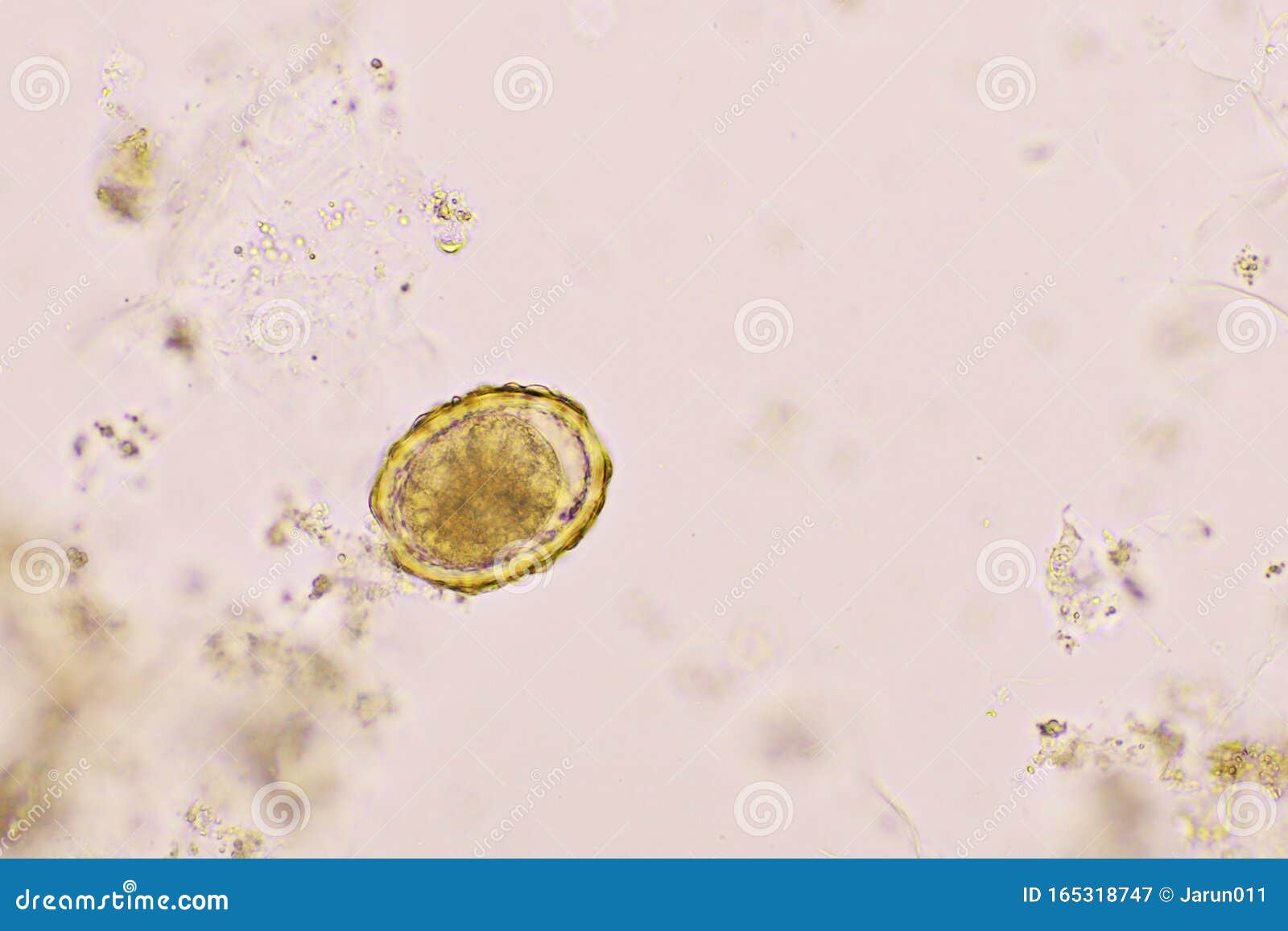 Egg of Ascaris Lumbricoides in Human Stool 库存图片 - 图片 包括有 感染, 蛔虫: 165318747