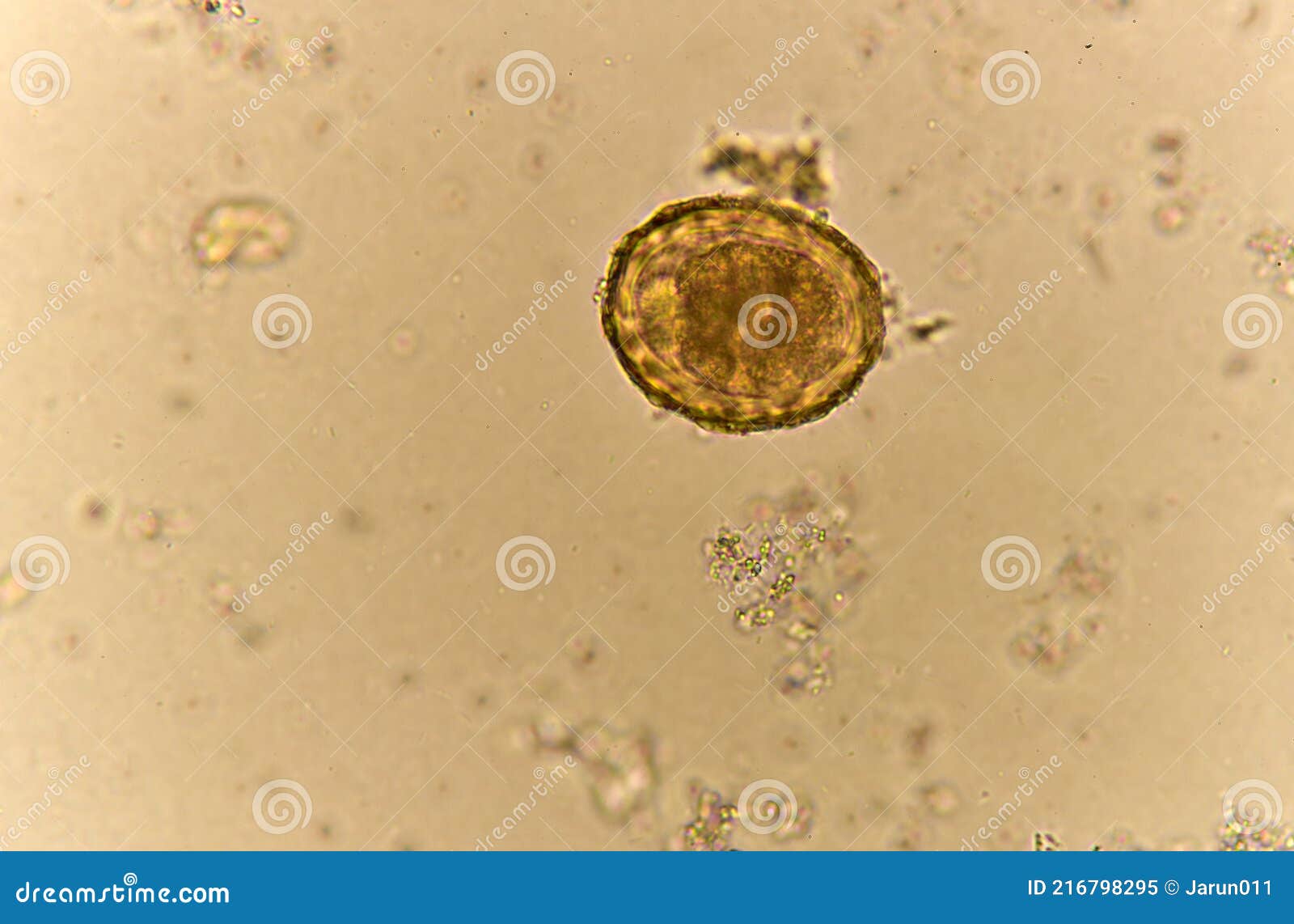Roundworm Eggs In Human Stool