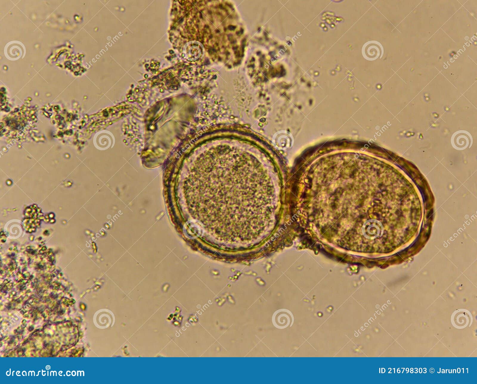 Egg of Ascaris Lumbricoides in Human Stool Stock Image - Image of ... Egg of Ascaris Lumbricoides in Human Stool Stock Image - Image of ...