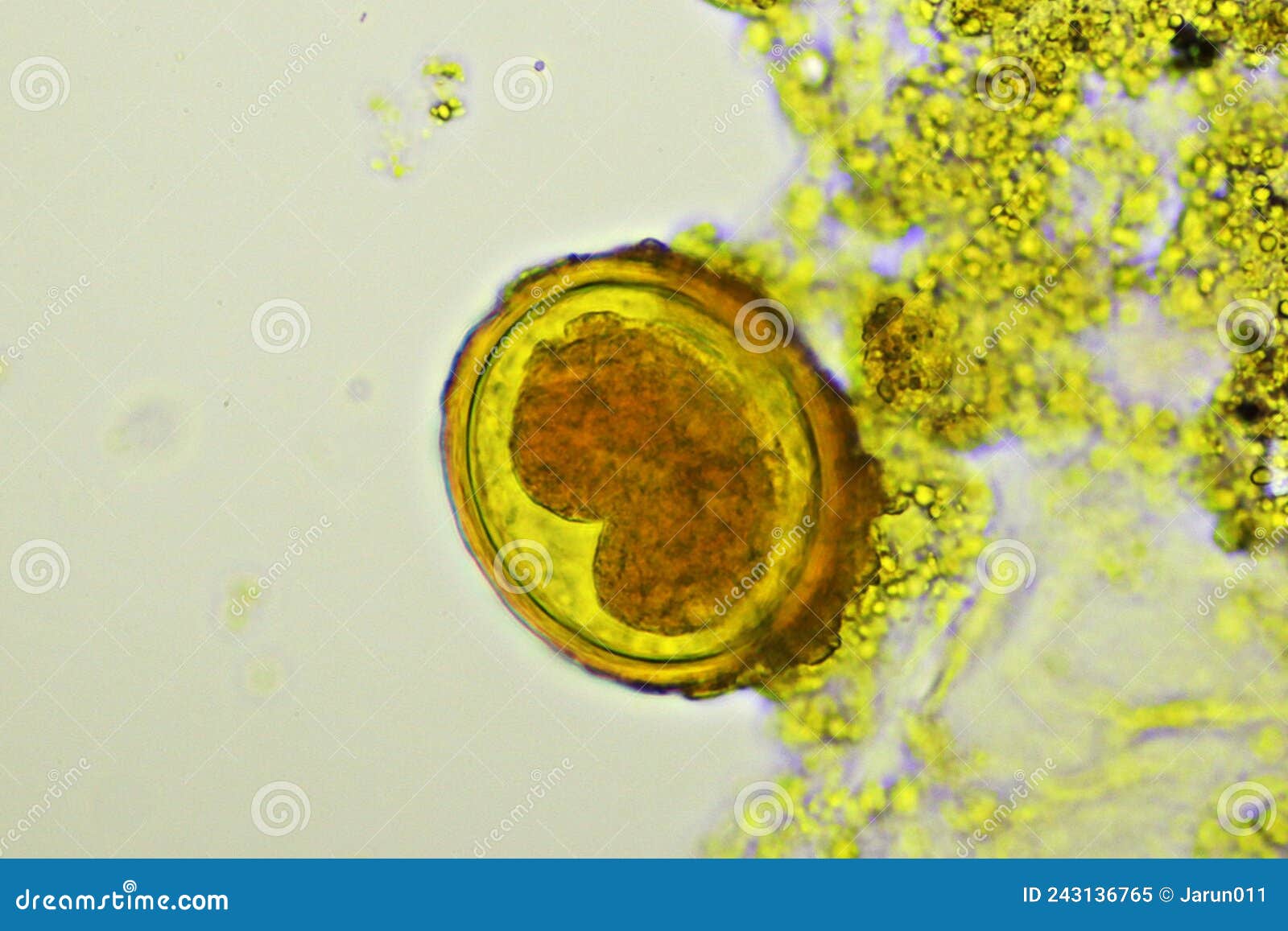 Human Roundworm Stool