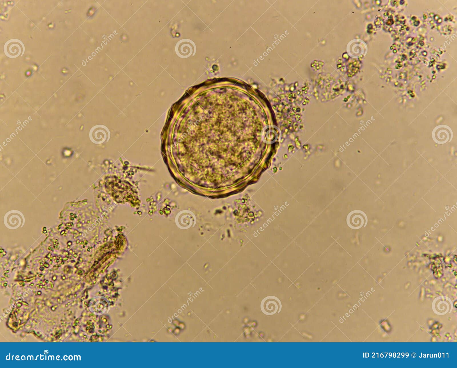 Egg of Ascaris Lumbricoides in Human Stool Stock Image - Image of ...