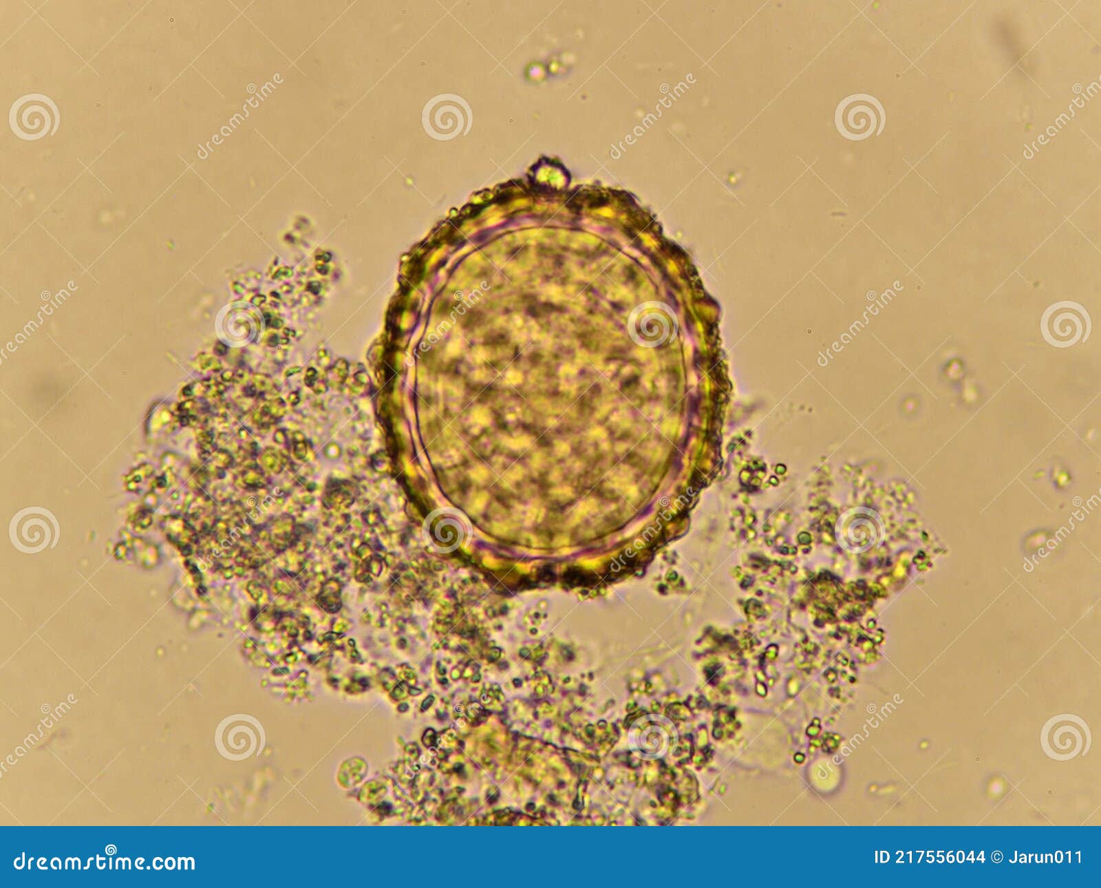 Egg of Ascaris Lumbricoides Roundworm in Human Stool Stock Photo ...
