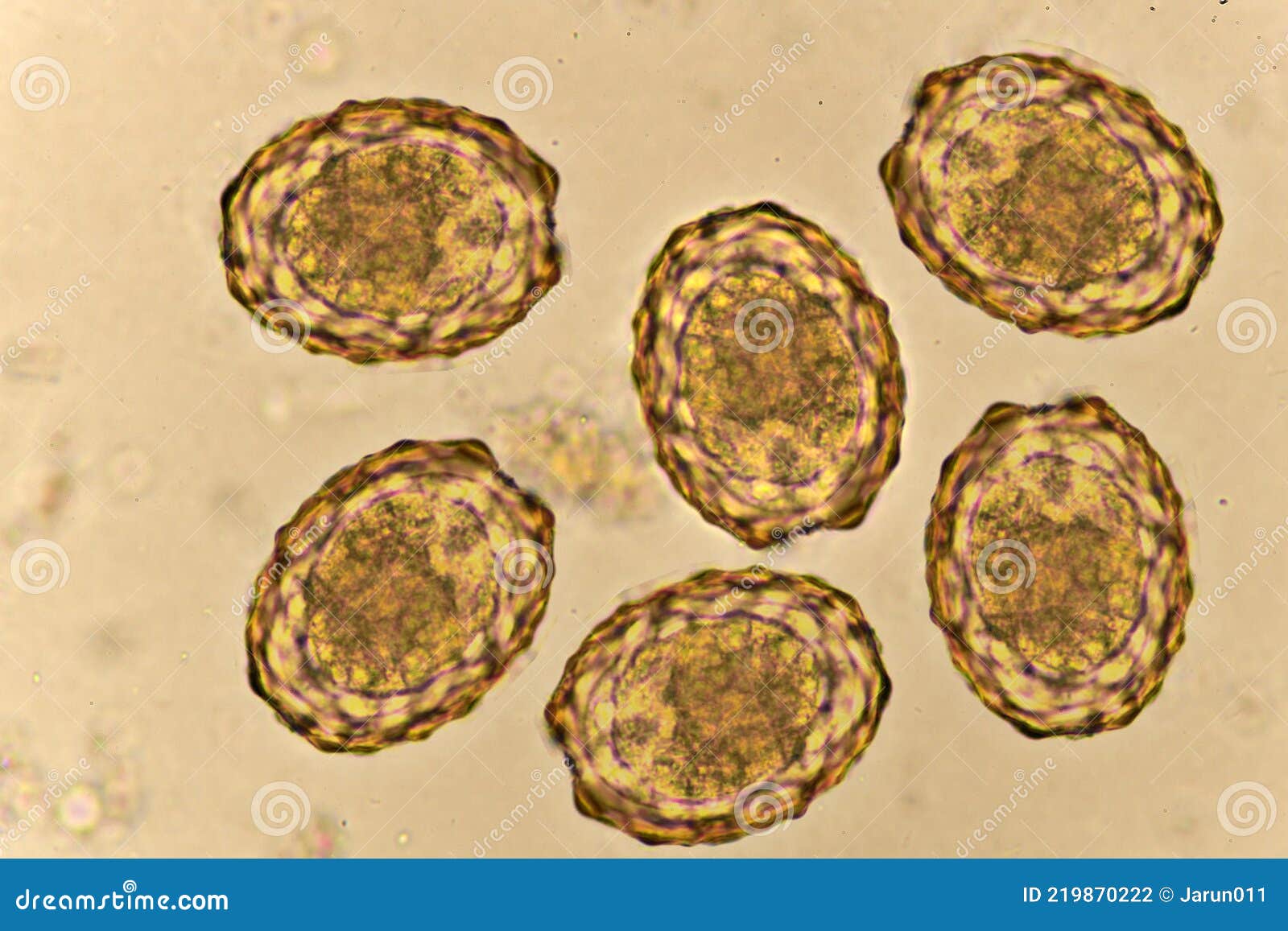 Egg of Ascaris Lumbricoides Roundworm in Human Stool Stock Photo ...