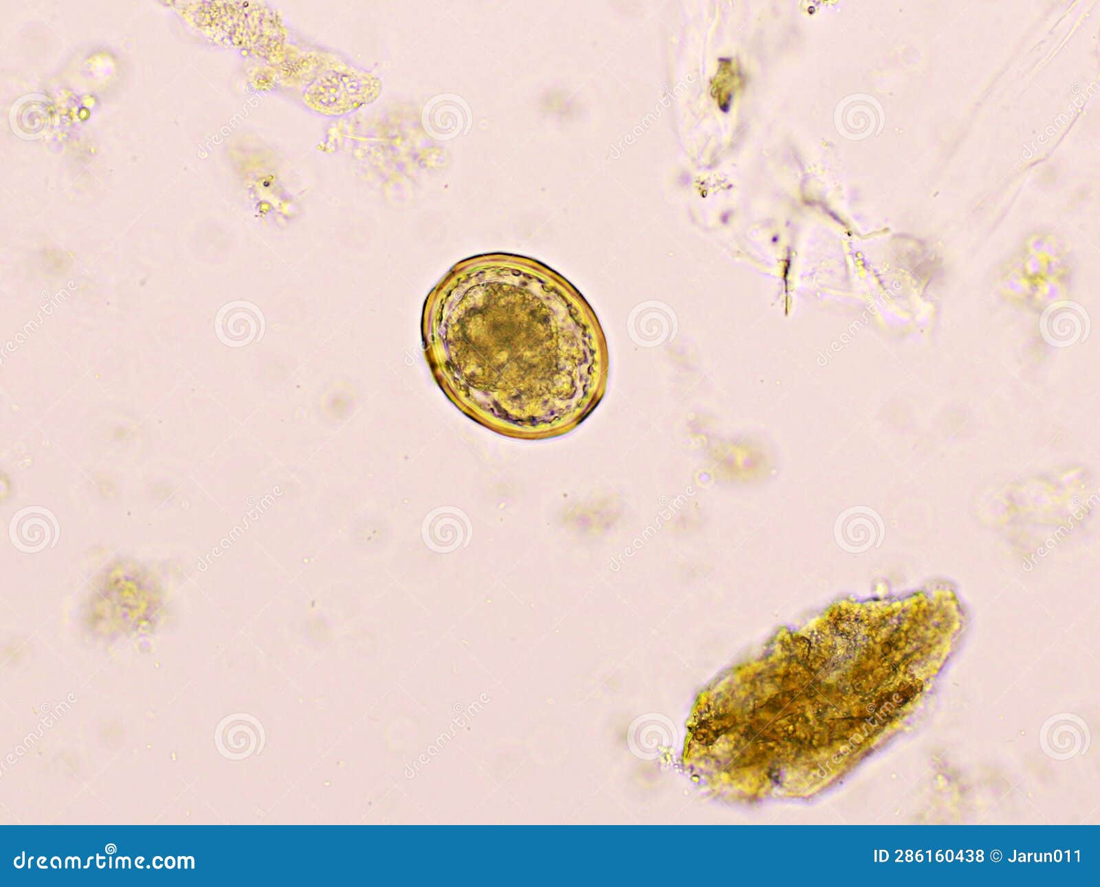 Egg of Ascaris Lumbricoides (roundworm) Stock Photo - Image of ...