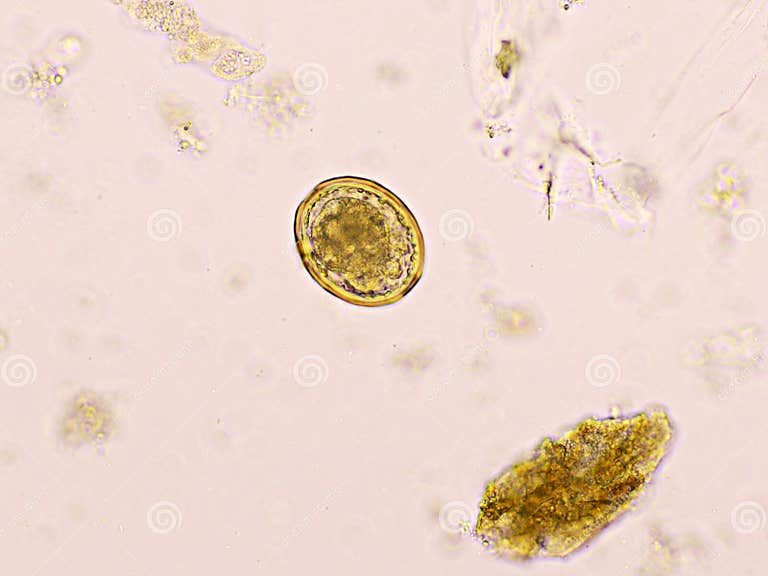 Egg of Ascaris Lumbricoides (roundworm) Stock Photo - Image of ...