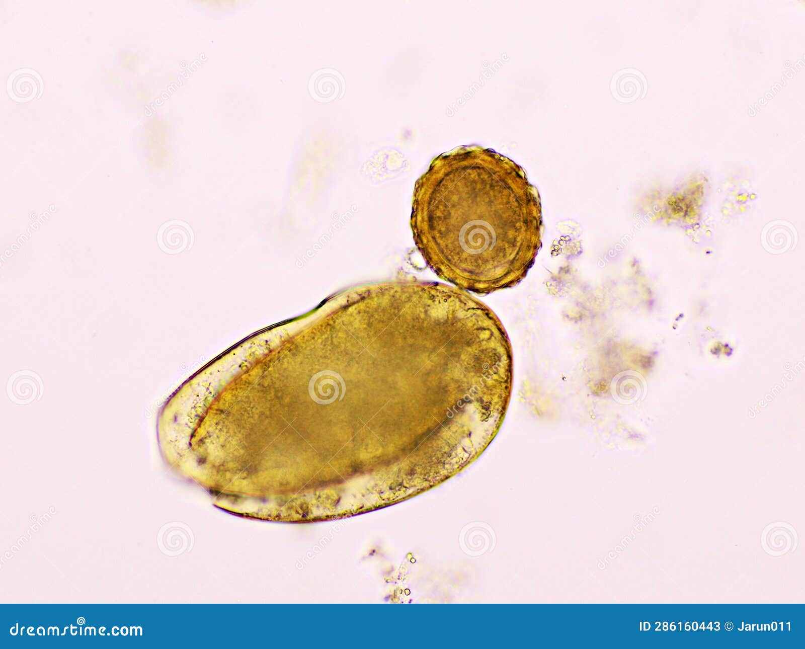 Egg of Ascaris Lumbricoides (roundworm) Stock Image - Image of ...