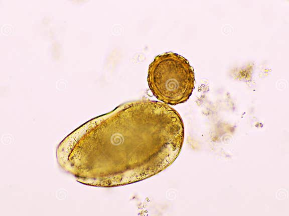 Egg of Ascaris Lumbricoides (roundworm) Stock Image - Image of ...