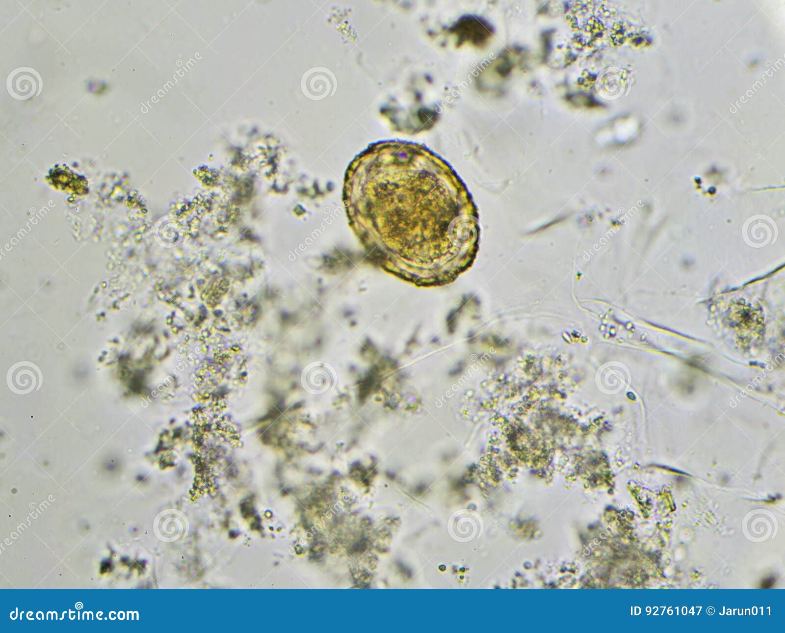 Egg of Ascaris Lumbricoides Roundworm Stock Image - Image of ascaris ...