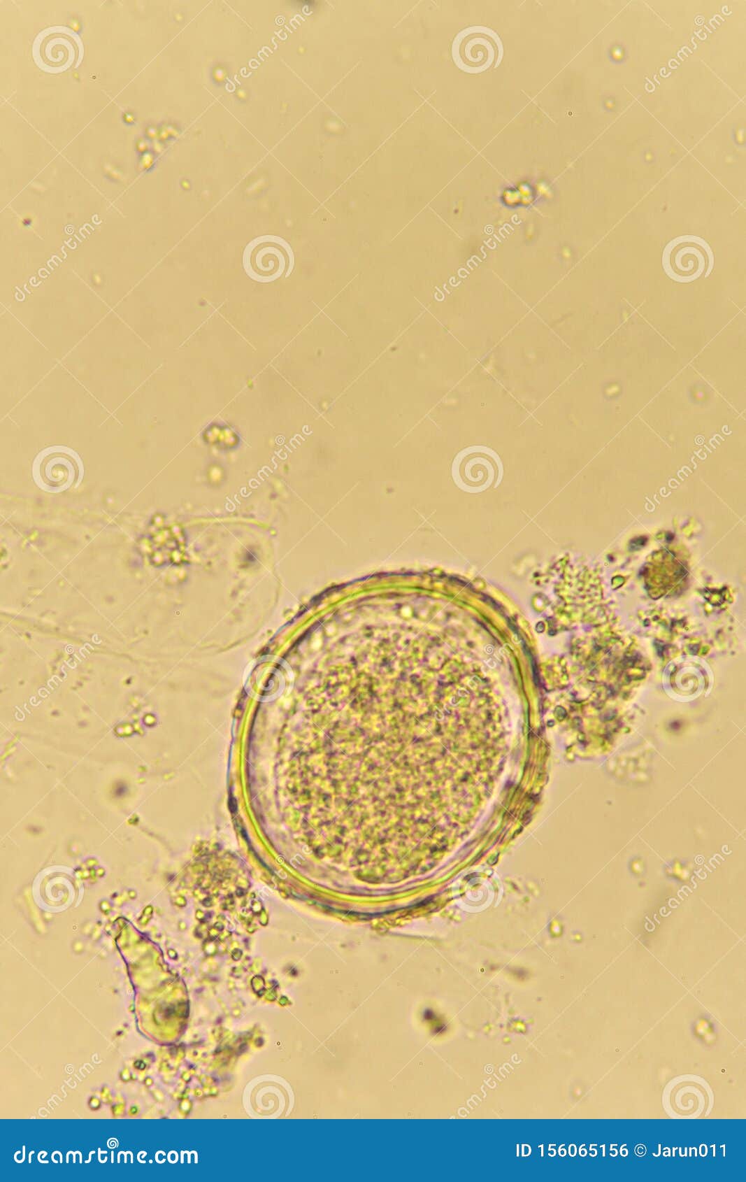 Egg of Ascaris Lumbricoides in Stool Stock Photo - Image of medical ...